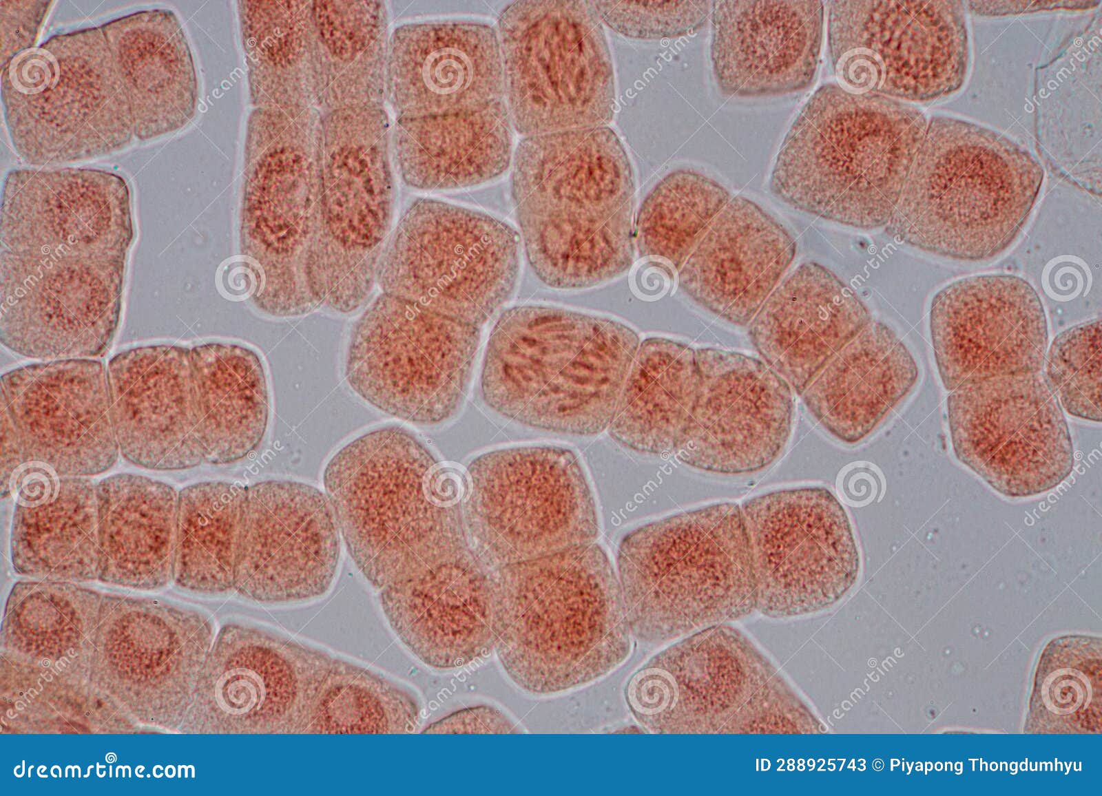 Mitosis Cell in the Root Tip of Onion Under a Microscope. Stock Image ...