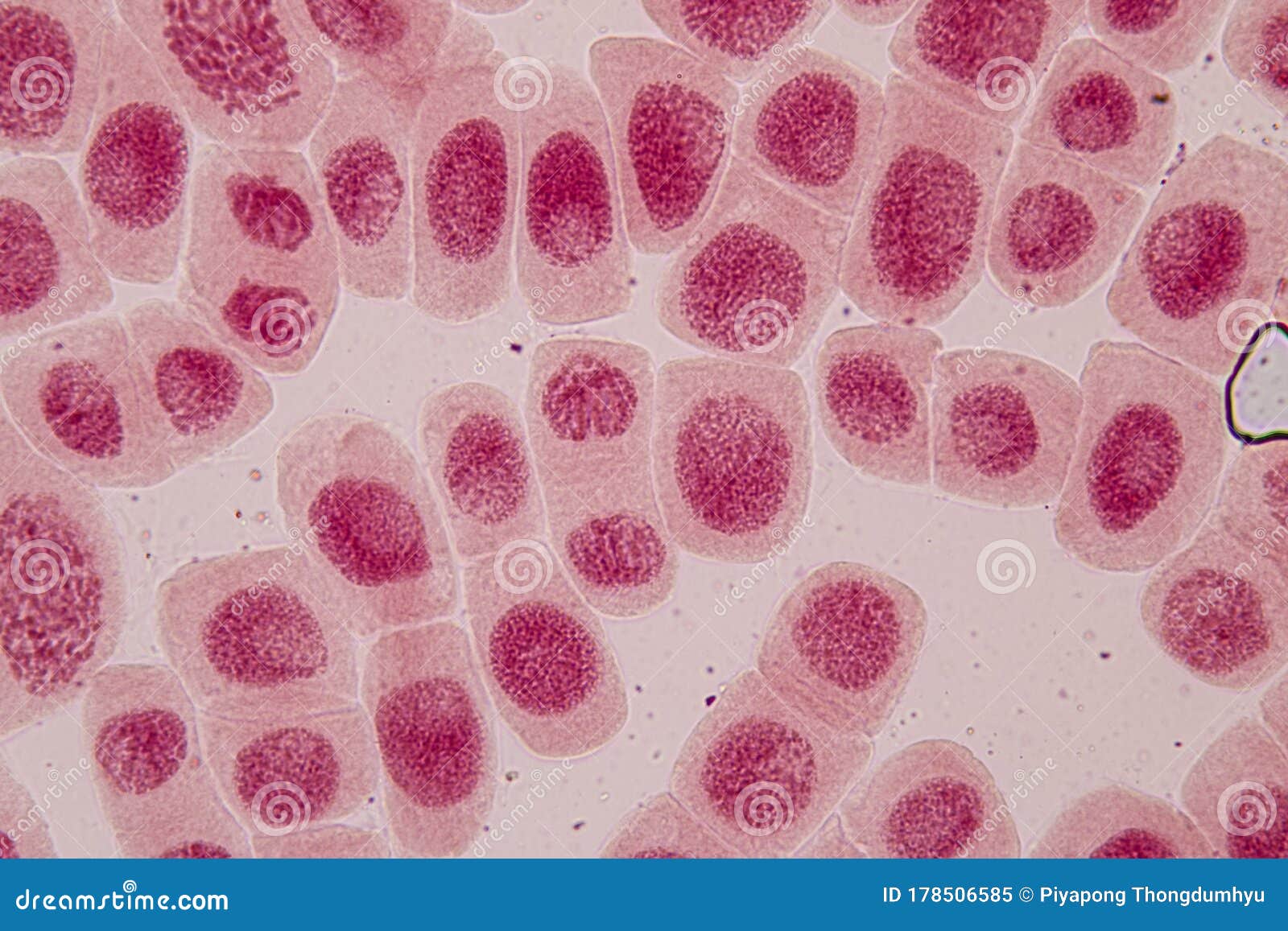 Mitosis Cell in the Root Tip of Onion Under a Microscope. Stock Image ...