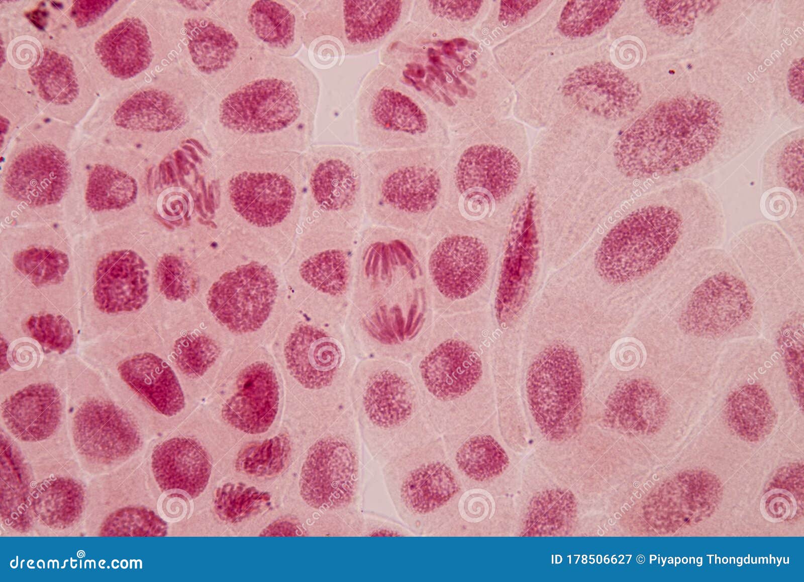 Mitosis Cell in the Root Tip of Onion Under a Microscope. Stock Image ...