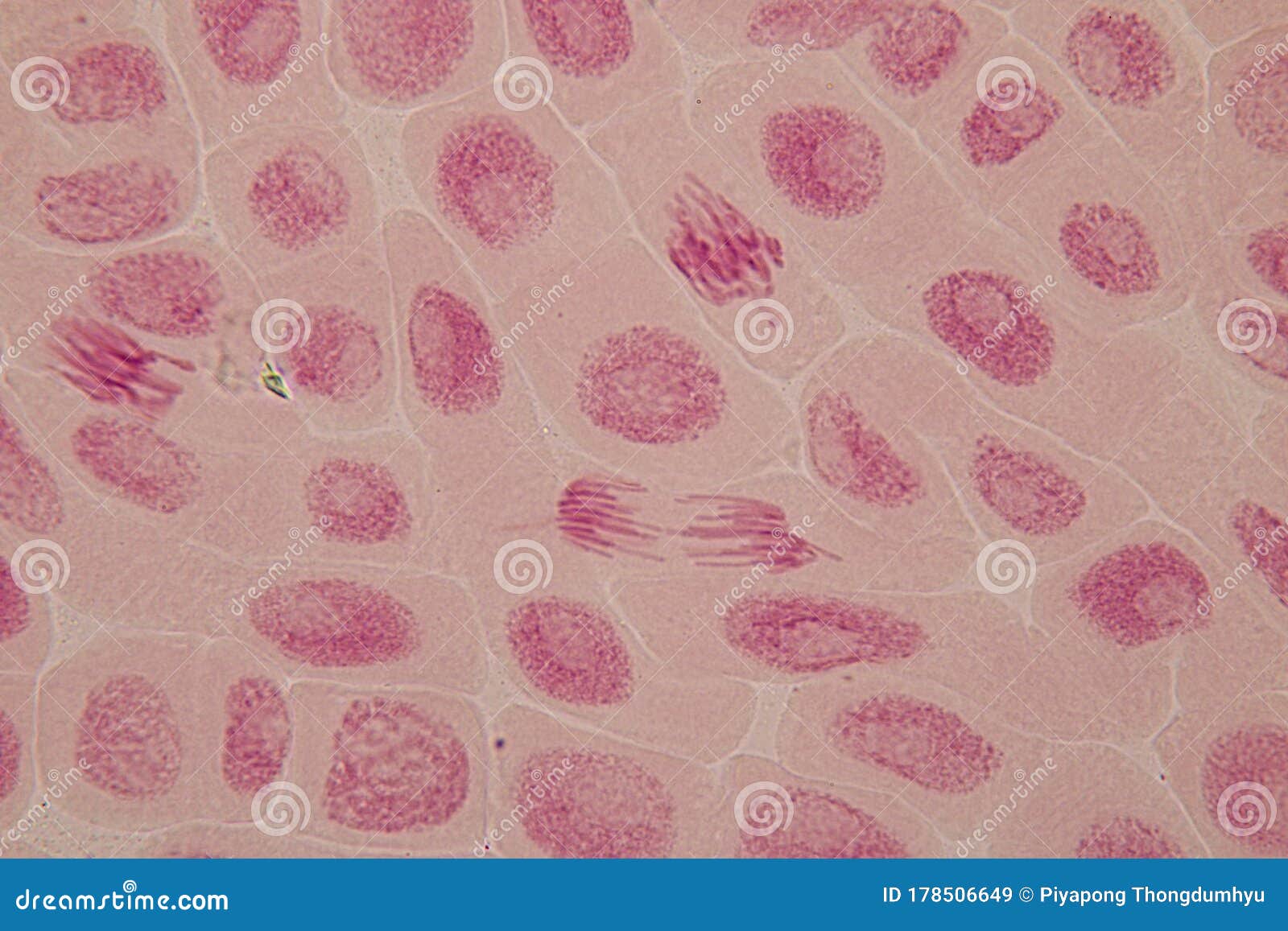 Mitosis Cell in the Root Tip of Onion Under a Microscope. Stock Image ...