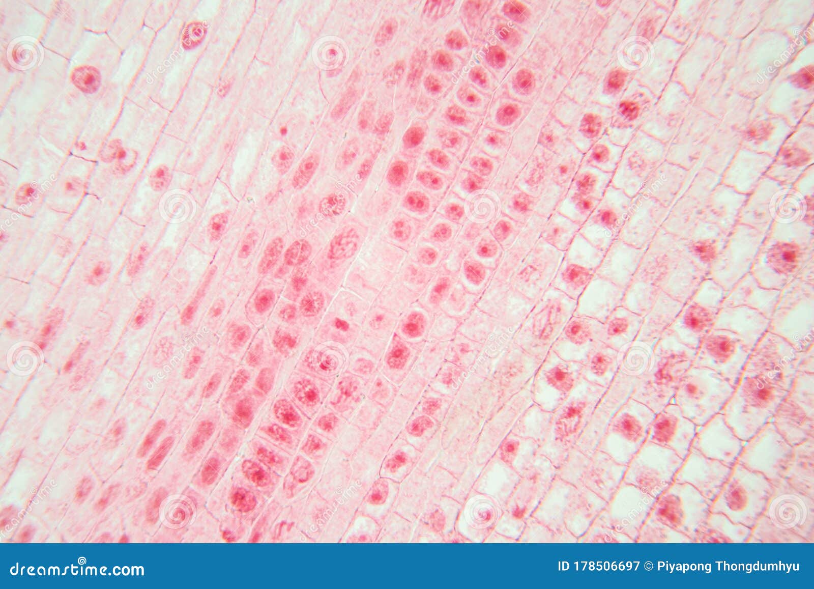 Mitosis Cell in the Root Tip of Onion Under a Microscope. Stock Image ...