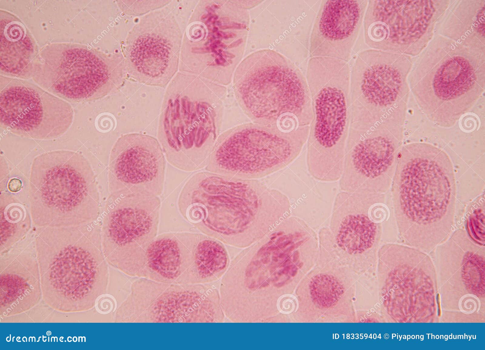 Mitosis Cell in the Root Tip of Onion Under a Microscope. Stock Photo ...