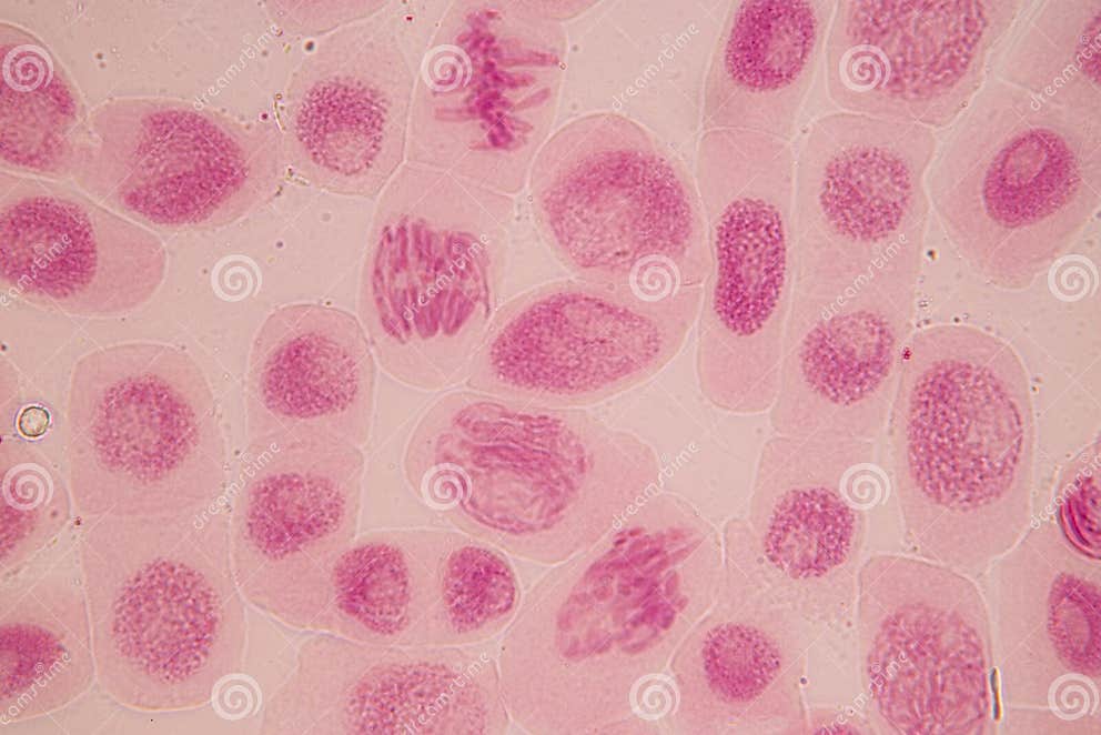 Mitosis Cell in the Root Tip of Onion Under a Microscope. Stock Photo ...
