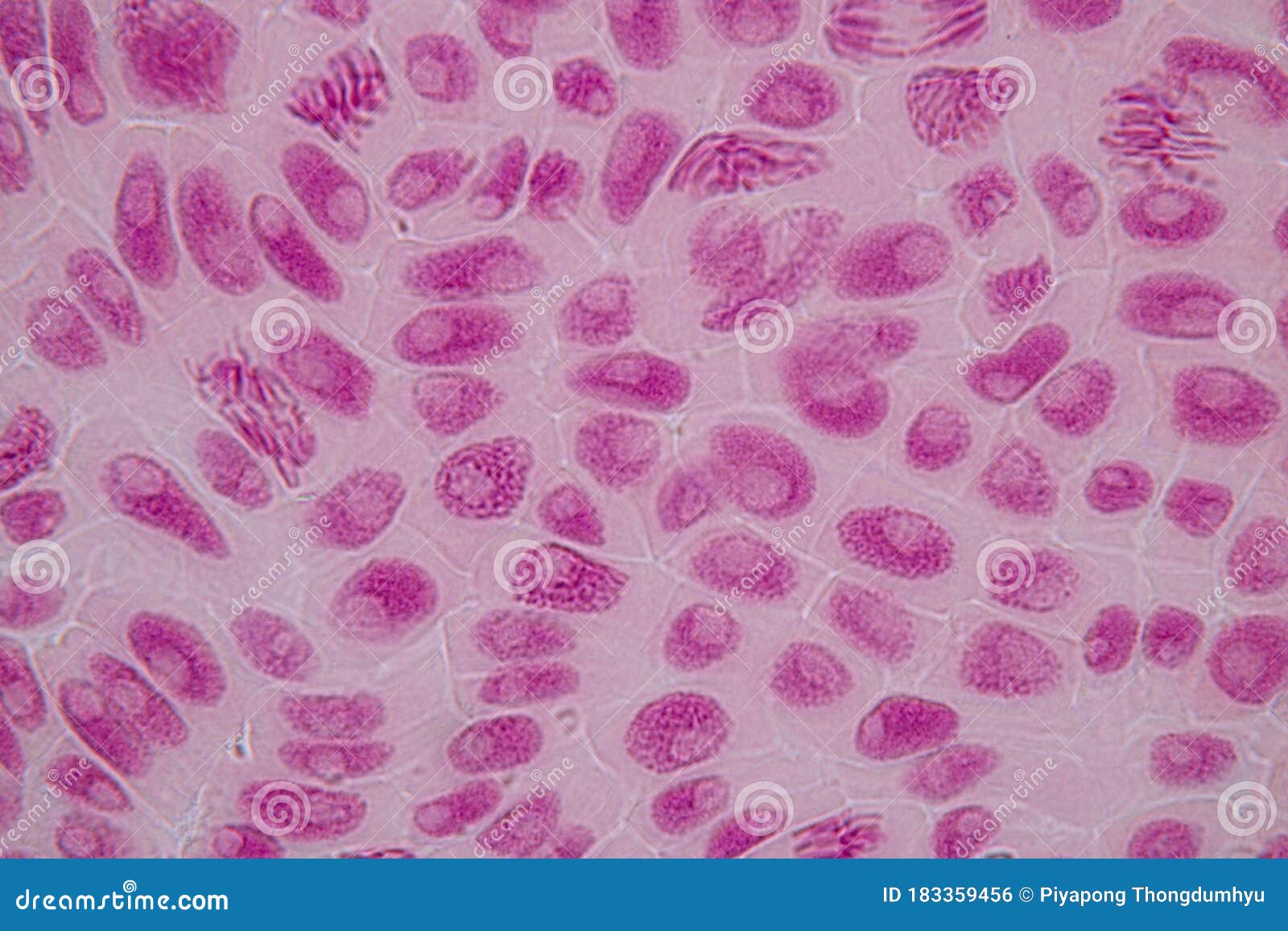 Mitosis Cell in the Root Tip of Onion Under a Microscope. Stock Photo ... Mitosis Cell in the Root Tip of Onion Under a Microscope. Stock Photo ...