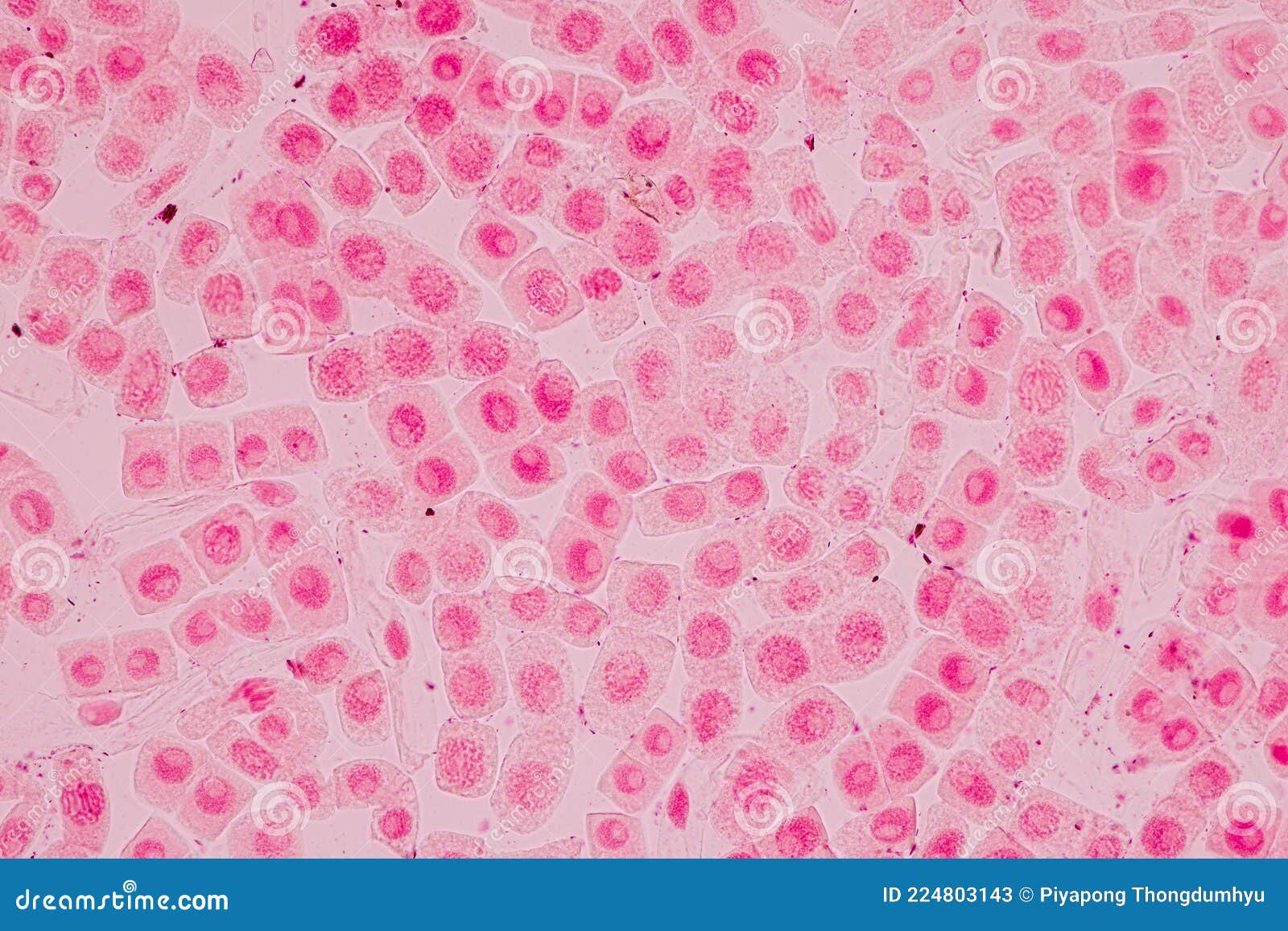 Mitosis Cell in the Root Tip of Onion Under a Microscope. Stock Image ...