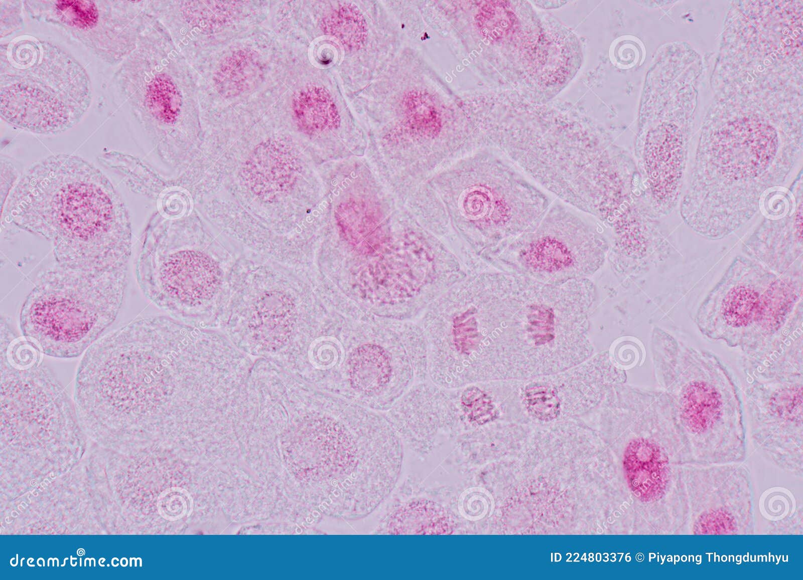 Metaphase Microscope