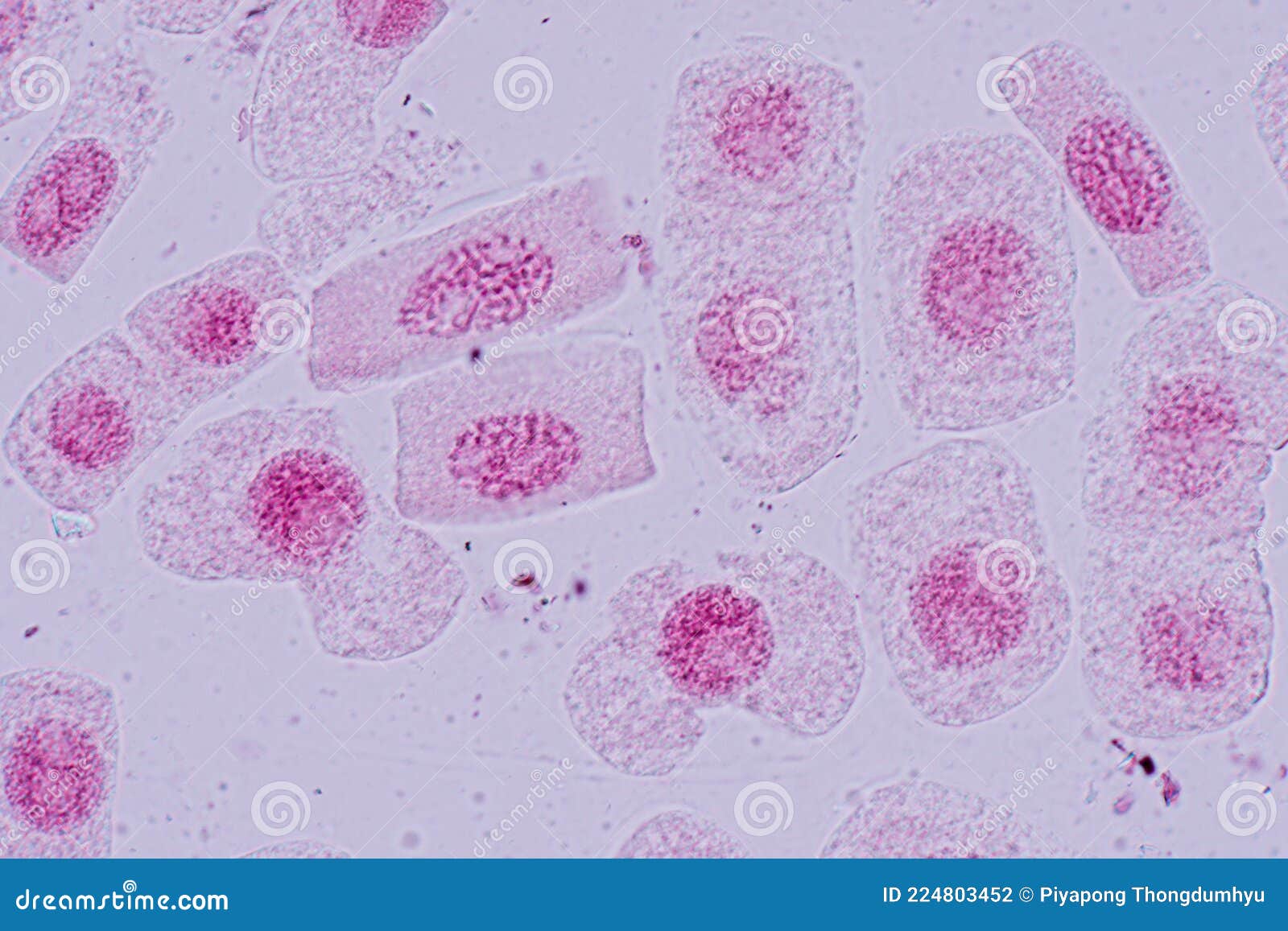 Mitosis Cell in the Root Tip of Onion Under a Microscope. Stock Photo ...