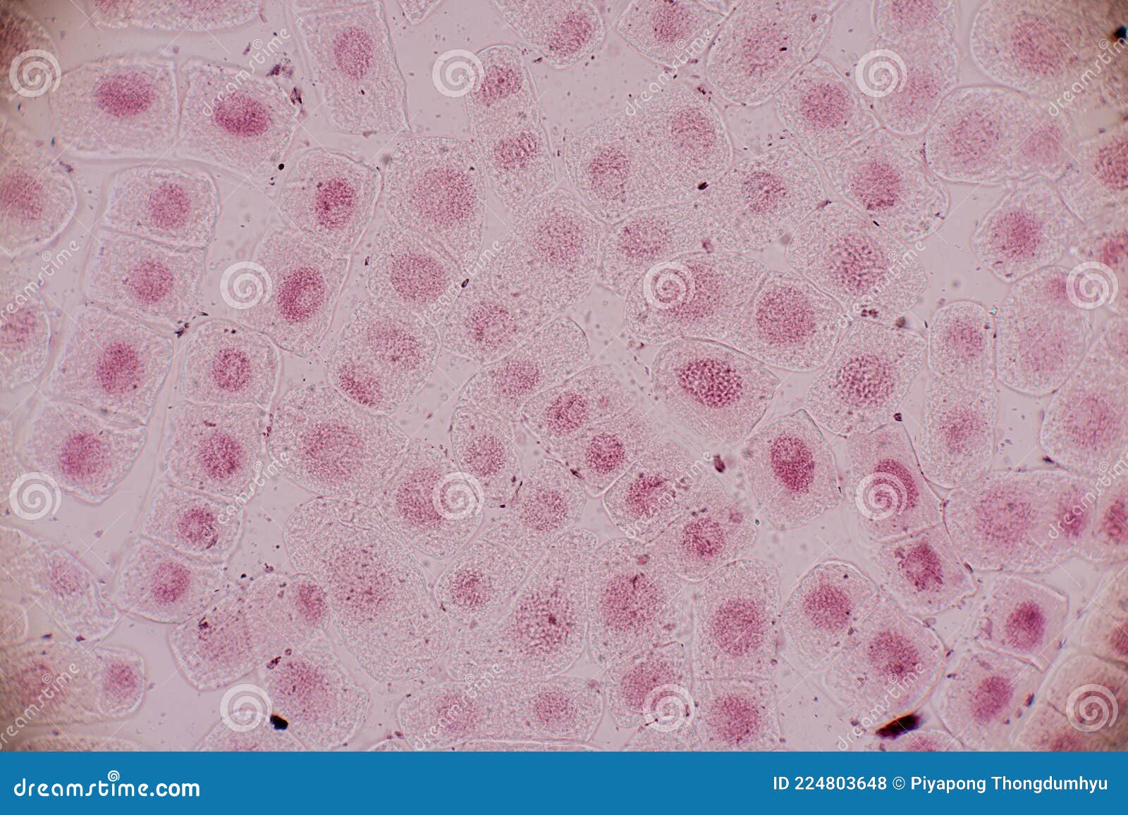 Mitosis Cell in the Root Tip of Onion Under a Microscope. Stock Photo ...
