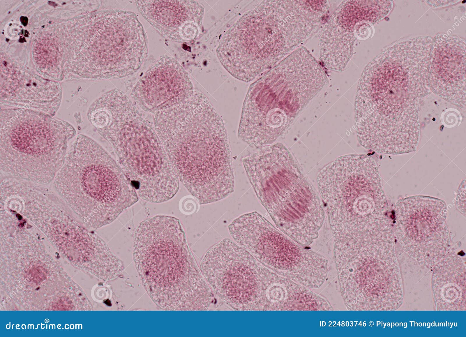 Mitosis Cell in the Root Tip of Onion Under a Microscope. Stock Photo ...