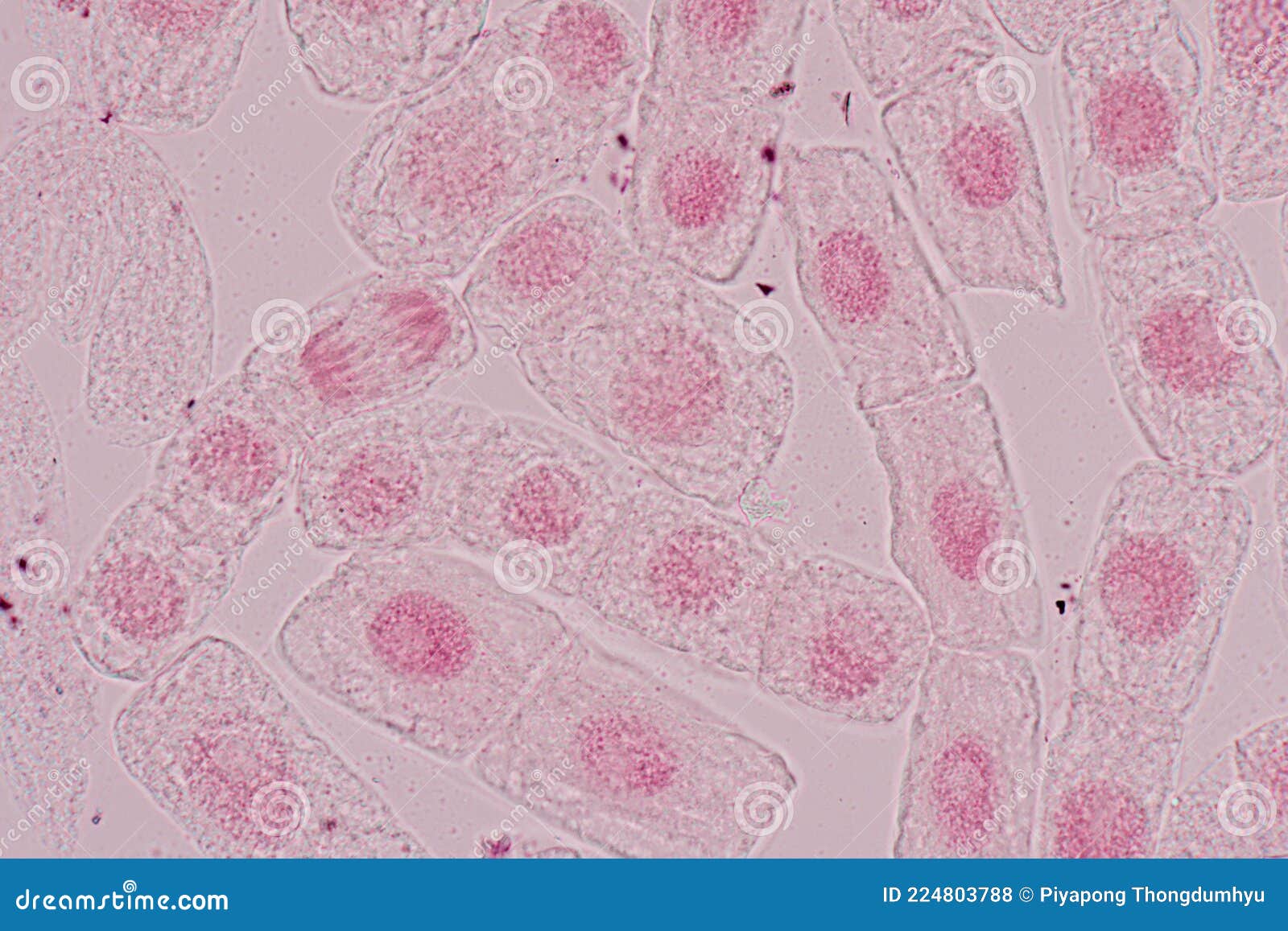 Mitosis Cell in the Root Tip of Onion Under a Microscope. Stock Photo ...