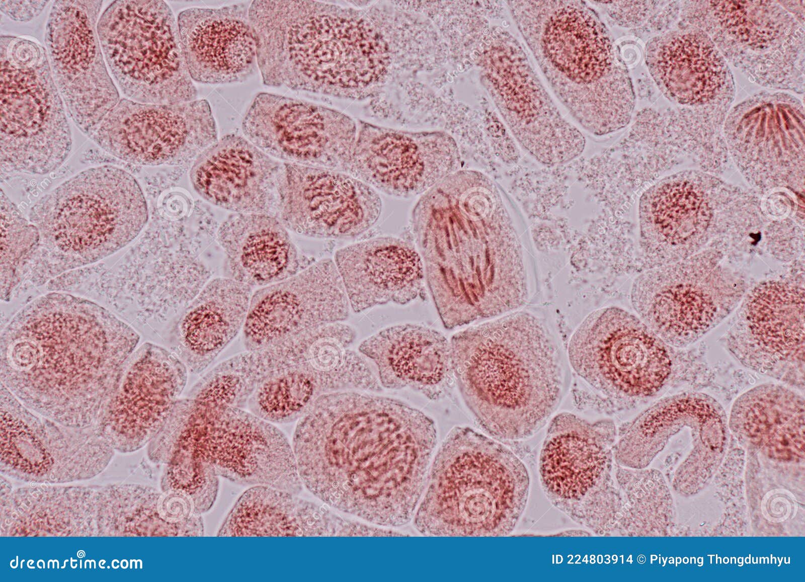 Mitosis Cell in the Root Tip of Onion Under a Microscope. Stock Photo ...