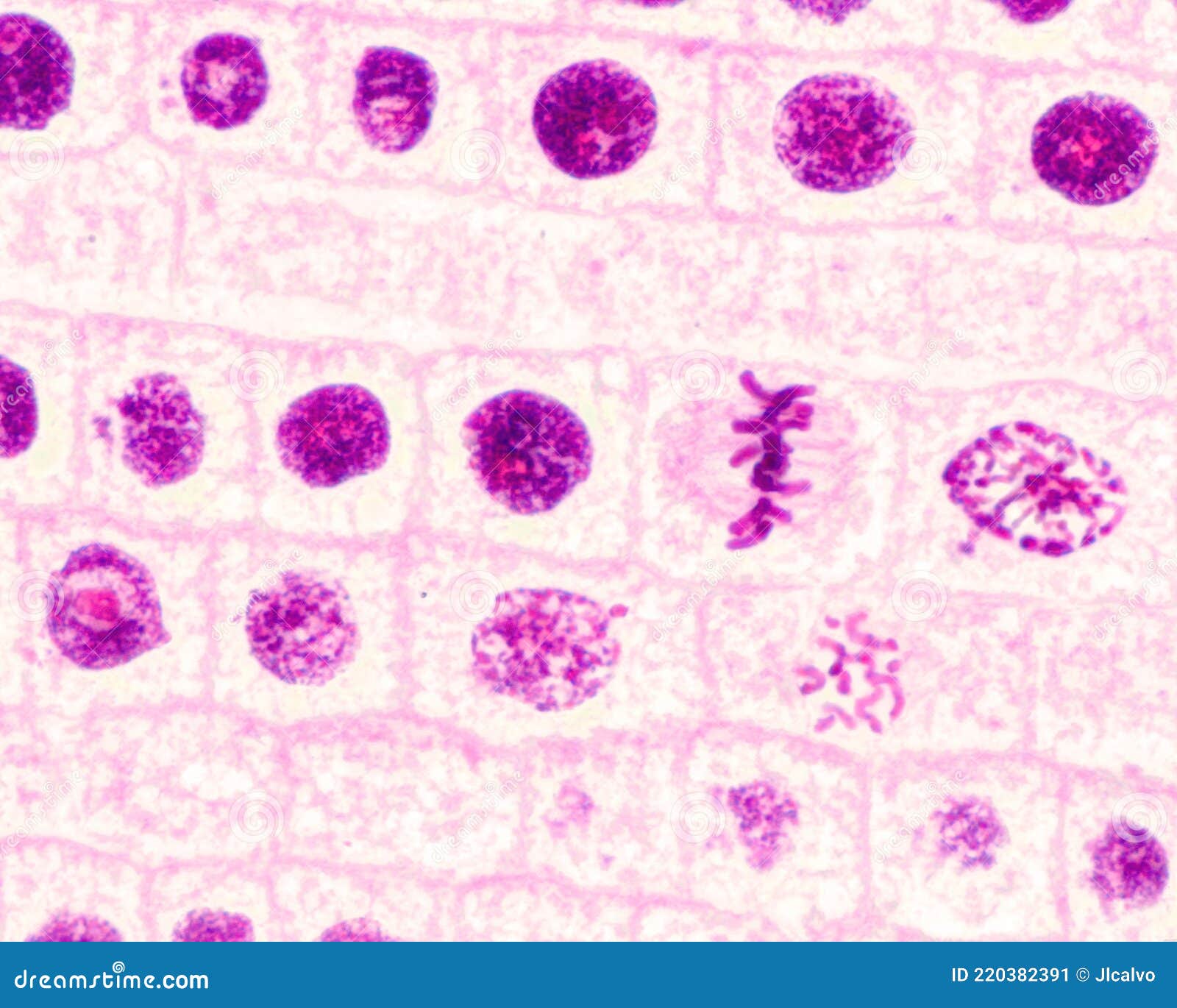 Mitosis Under Microscope Labeled