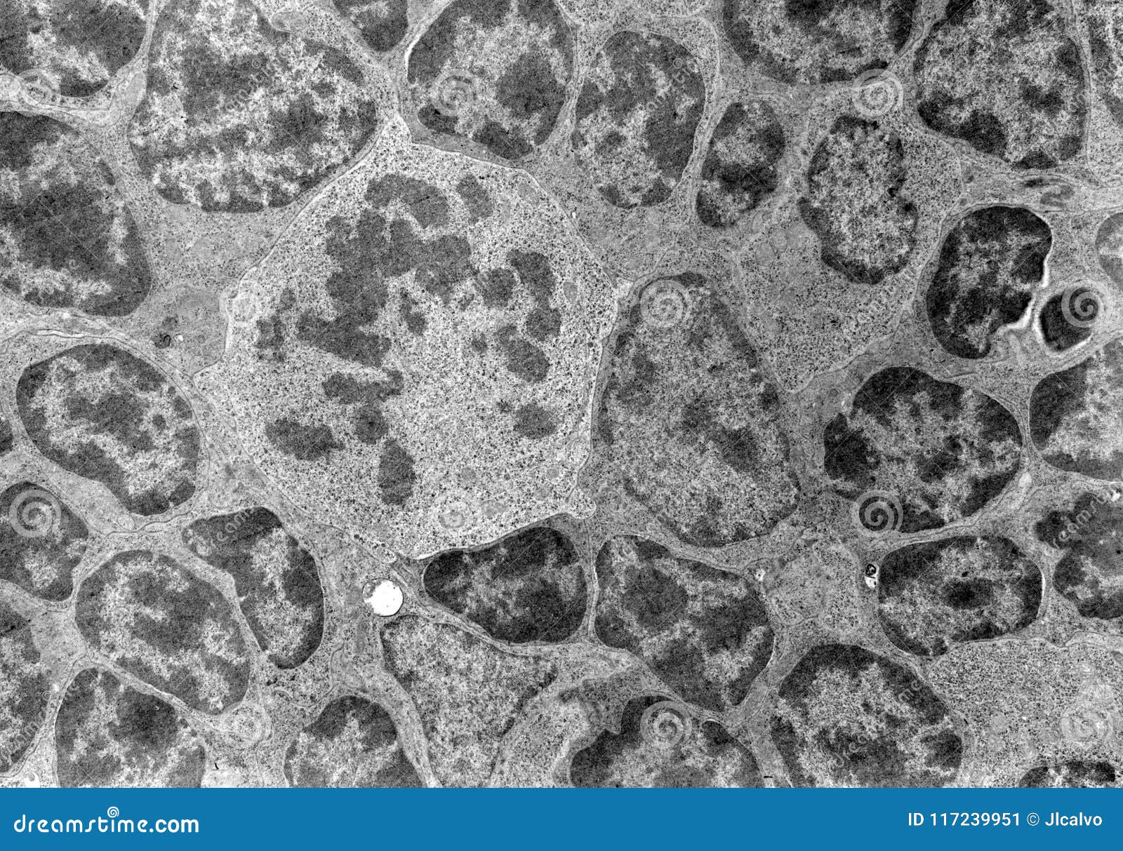 Mitoza TEM micrograph obraz stock. Obraz złożonej z micrography - 117239951