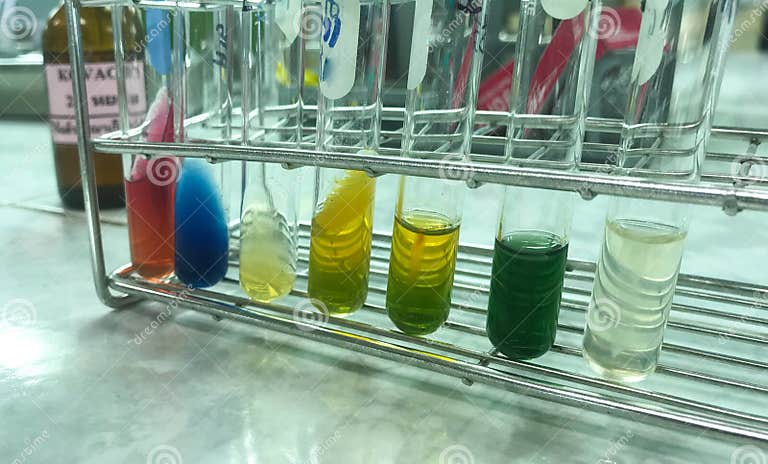 Mix Biochemical Test in Microbiology Laboratory Stock Image - Image of ...