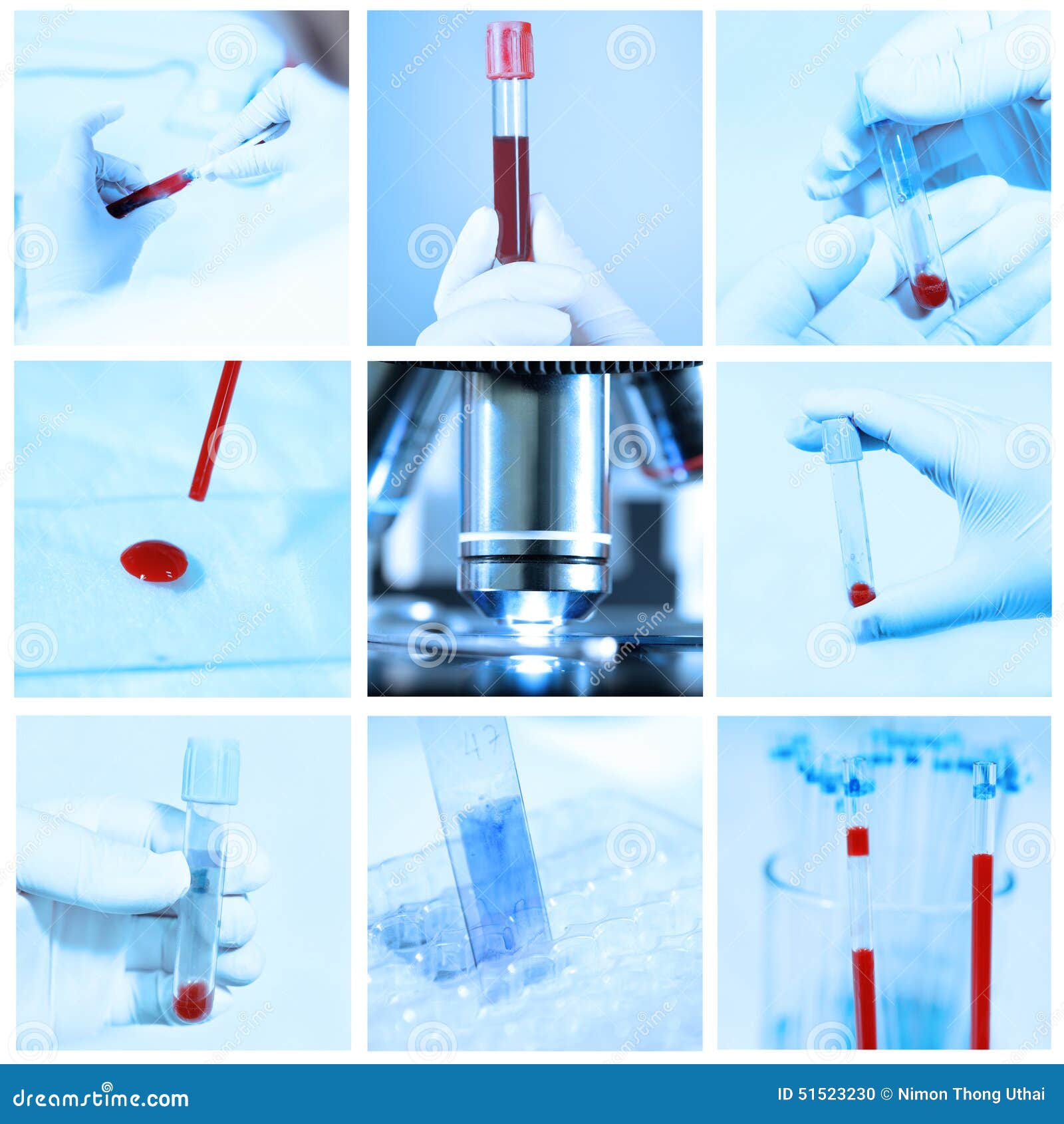 Mix of Blood Test in a Laboratory Stock Photo - Image of hospital ...