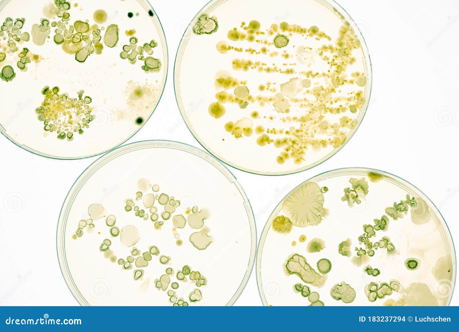 Mixed of Bacteria Colonies and Fungus in Various Petri Dish Stock Photo ...