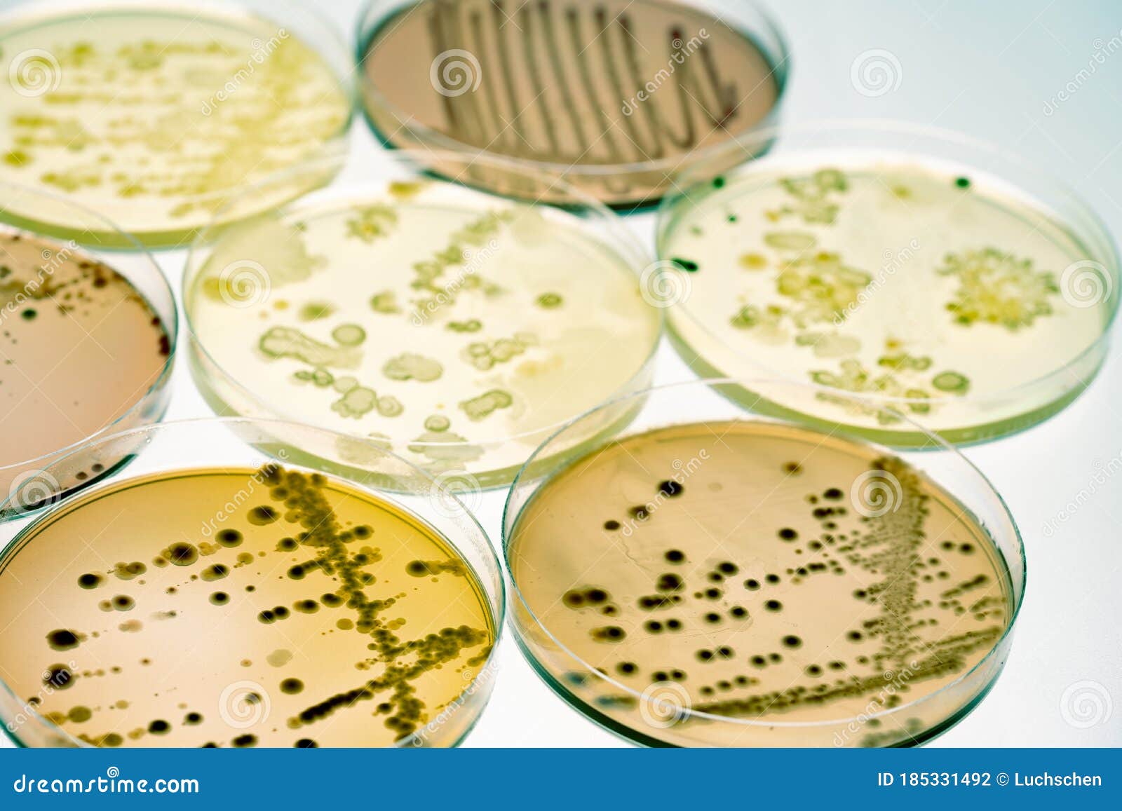 Mixed of Bacteria Colonies and Fungus in Various Petri Dish Stock Photo ...