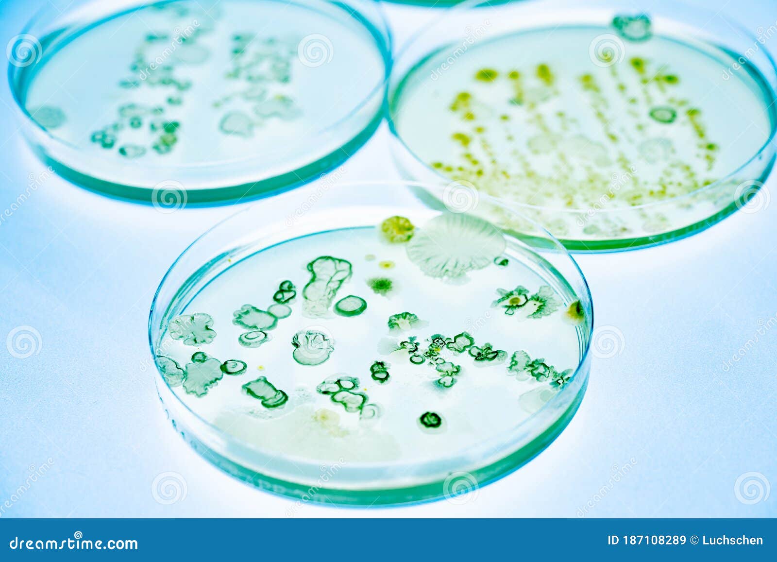 Mixed of Bacteria Colonies and Fungus in Various Petri Dish Stock Image ...