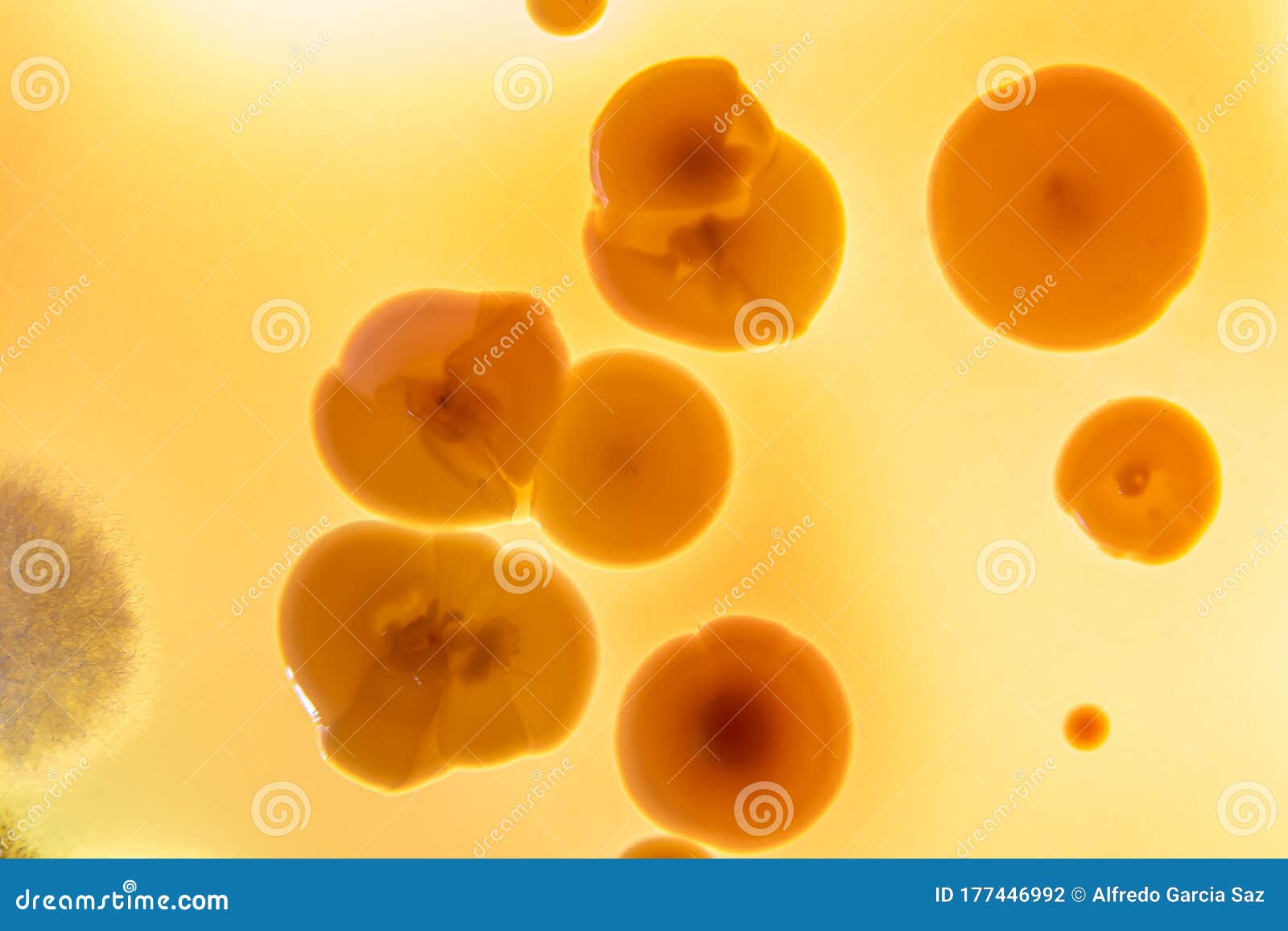 Mixed of Bacteria Colonies in Petri Dish Stock Photo - Image of biology ...