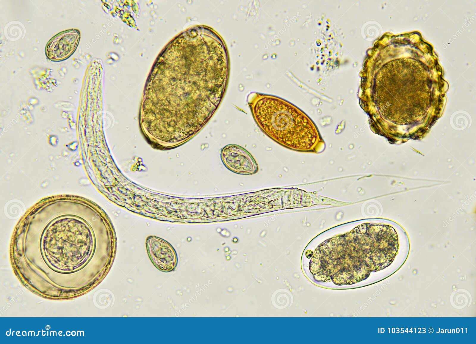 Mixed of Helminthes in Stool Stock Image - Image of microbiology ...