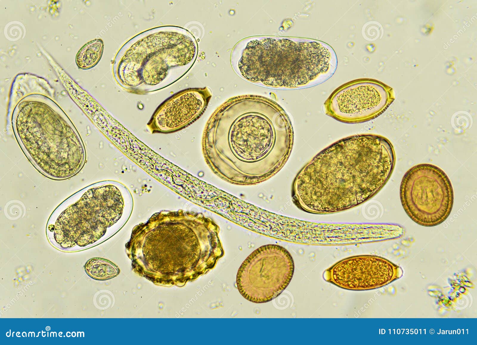 Mixed of Helminths in Stool Stock Image - Image of feces, analyzing ...