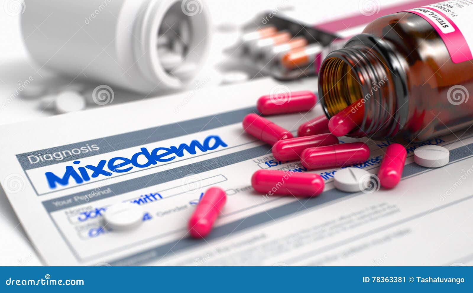 Mixedema - Inschrijving in Anamnese 3d Stock Afbeelding - Image of hart ...