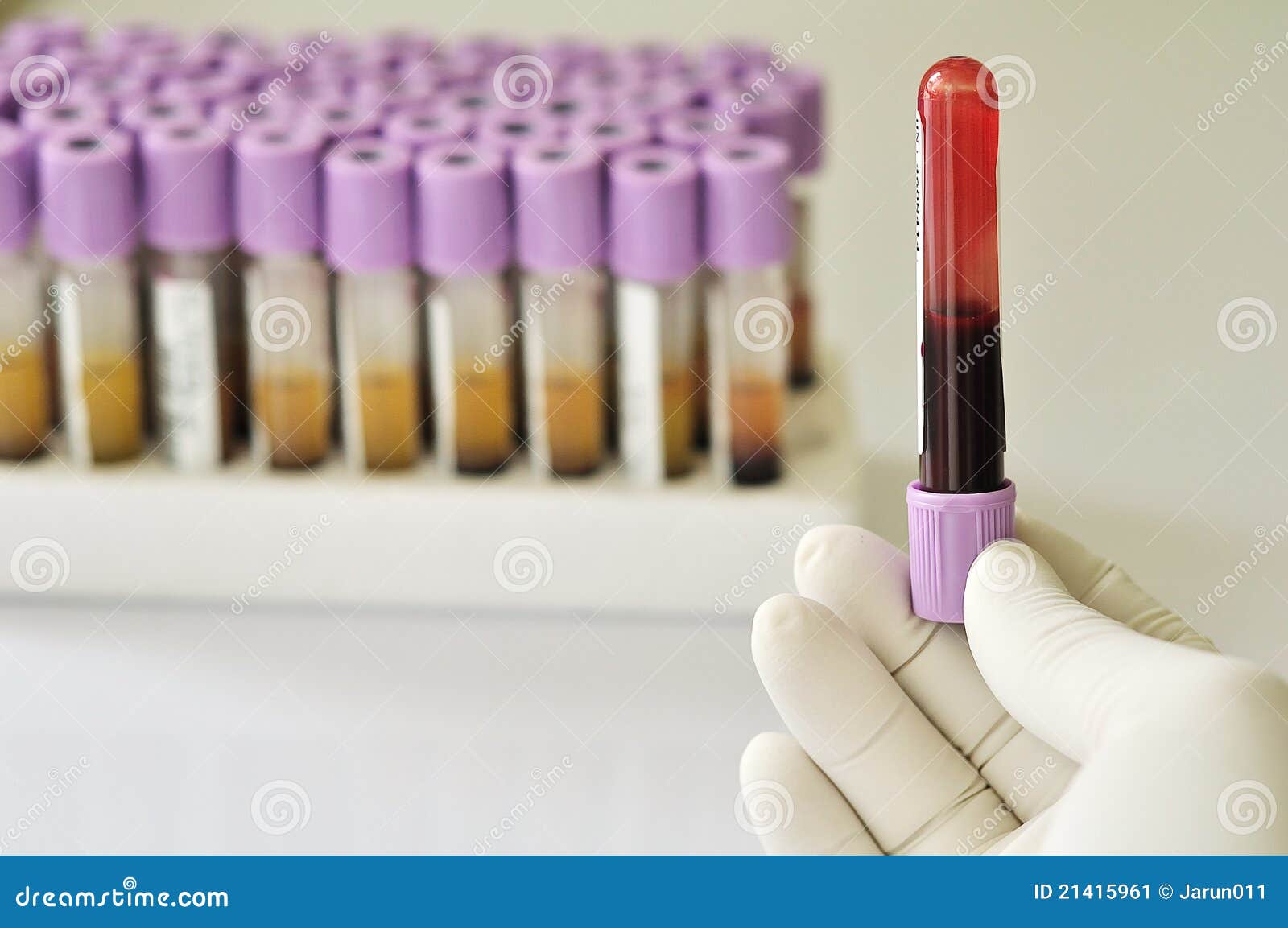 Mixing blood stock image. Image of examination, blood - 21415961