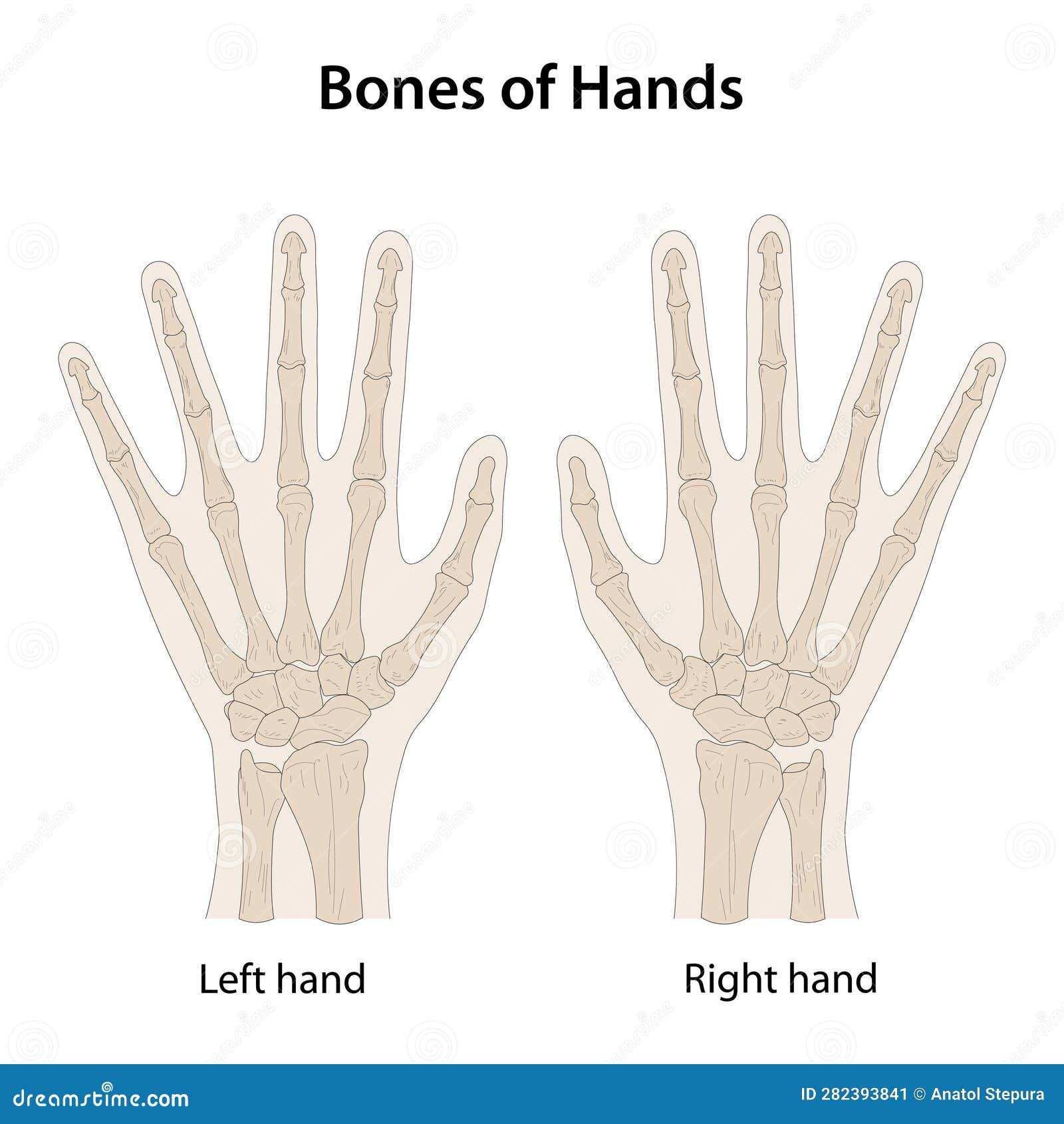 X-ray Dorsal Or Posterior View Of Right Human Hand Bones With Body ...