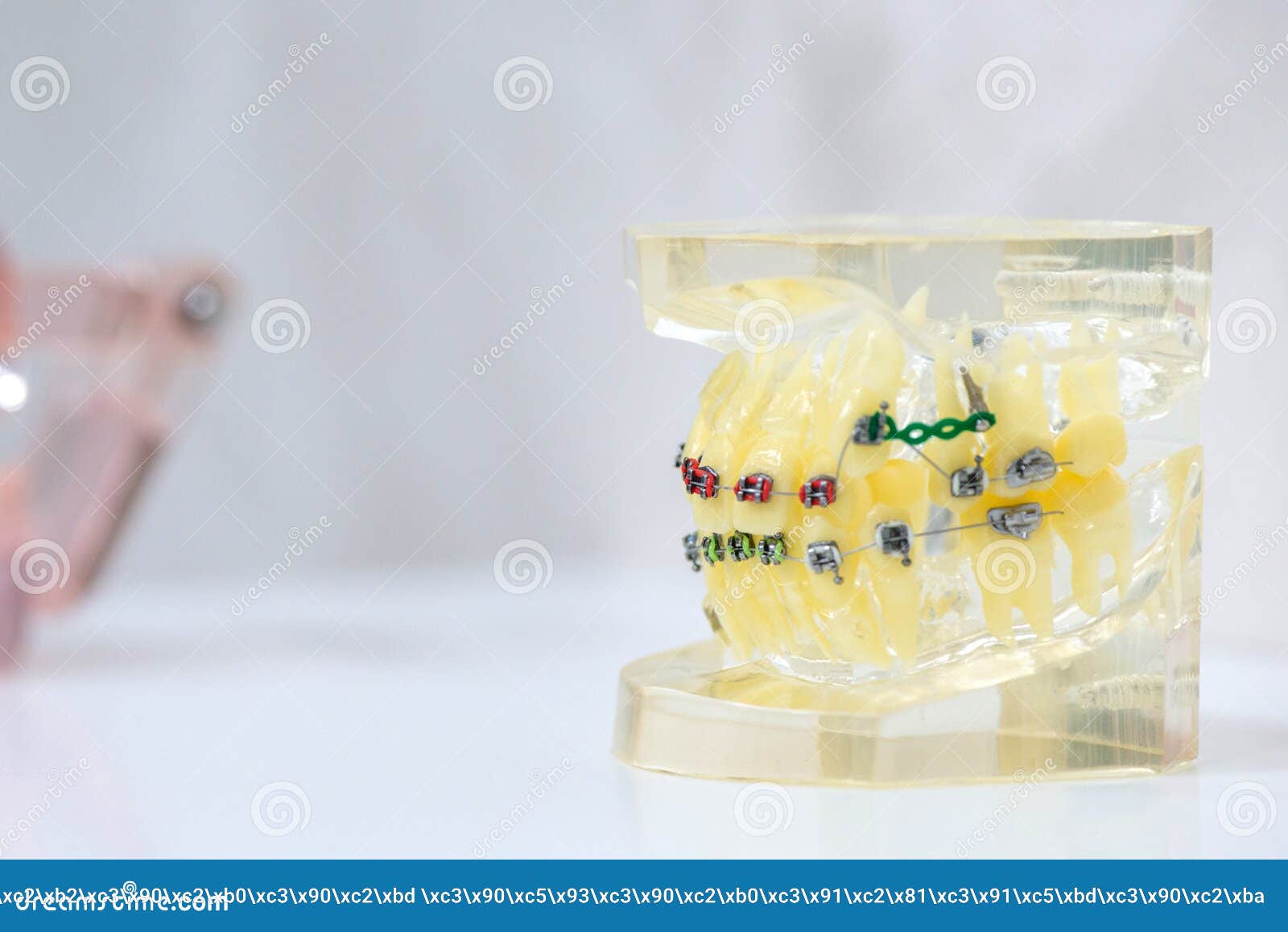 Mock Teeth with Braces. Demonstration Model of Teeth Editorial Stock ...