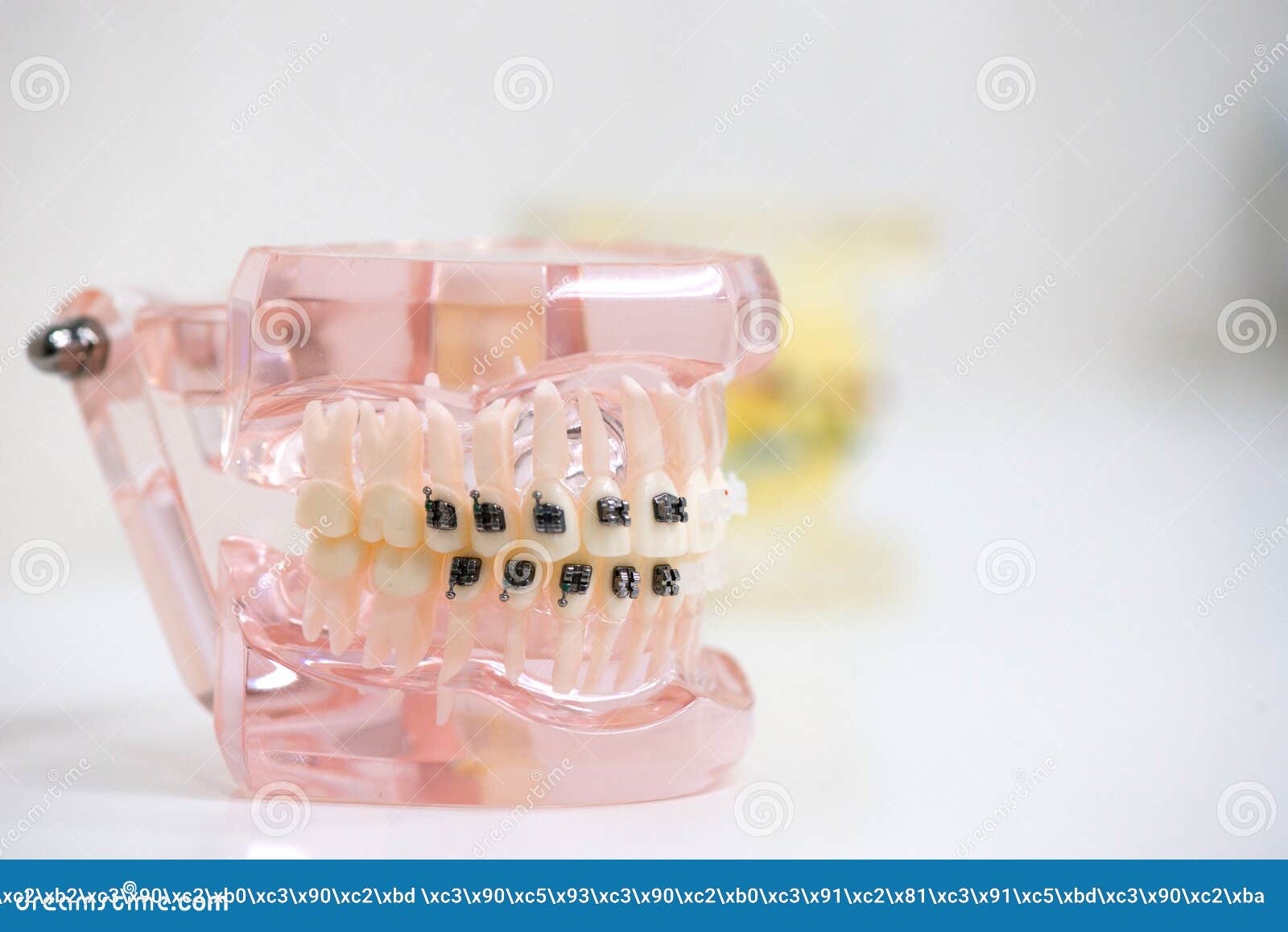 Mock Teeth with Braces. Demonstration Model of Teeth Editorial Stock ...