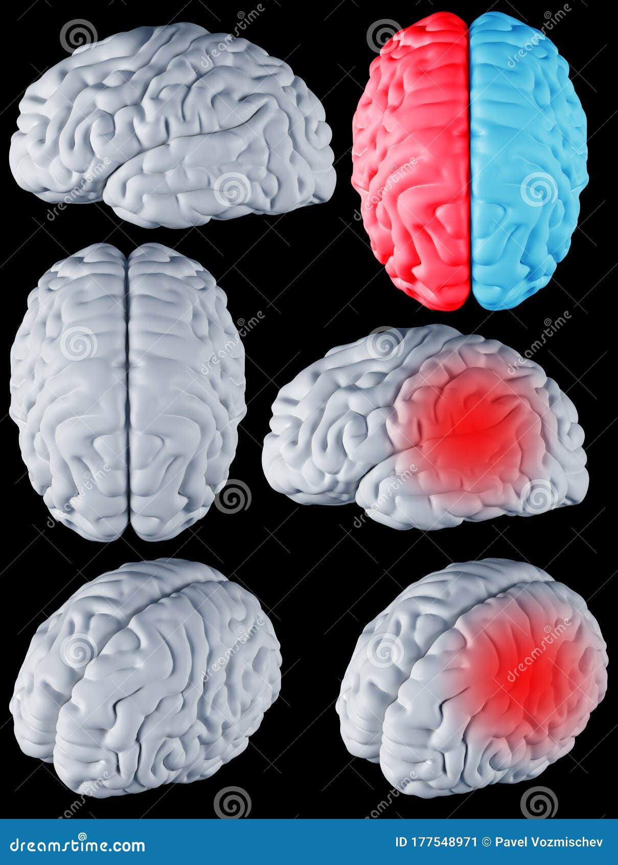 Brain Sides Royalty-Free Stock Photo | CartoonDealer.com #47004117