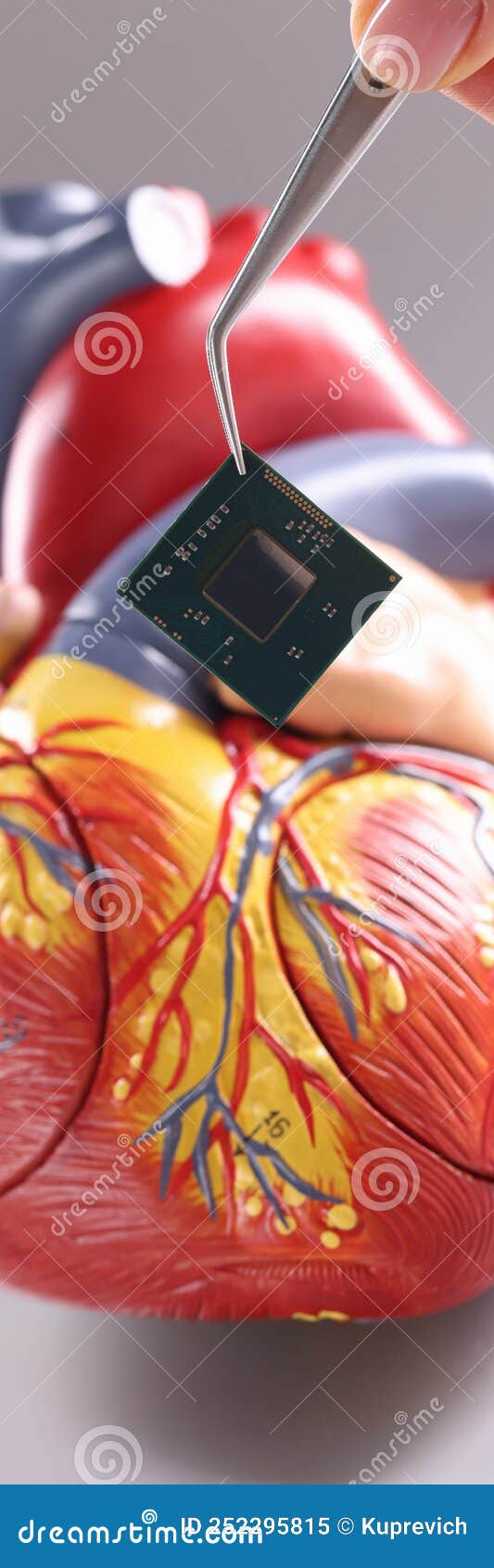 Model of Heart with Cardiac Pacemaker in Form of Chip Stock Image ...