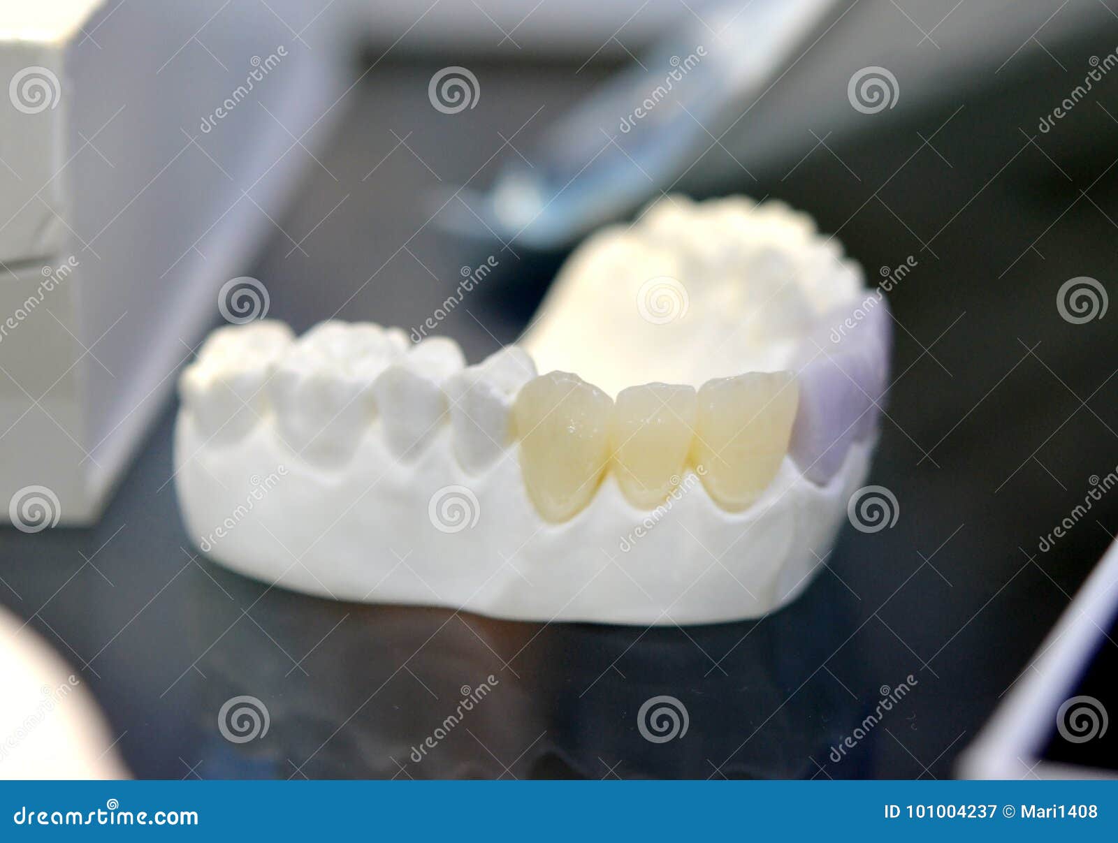 Model of the human jaw stock image. Image of clean, artificial - 101004237
