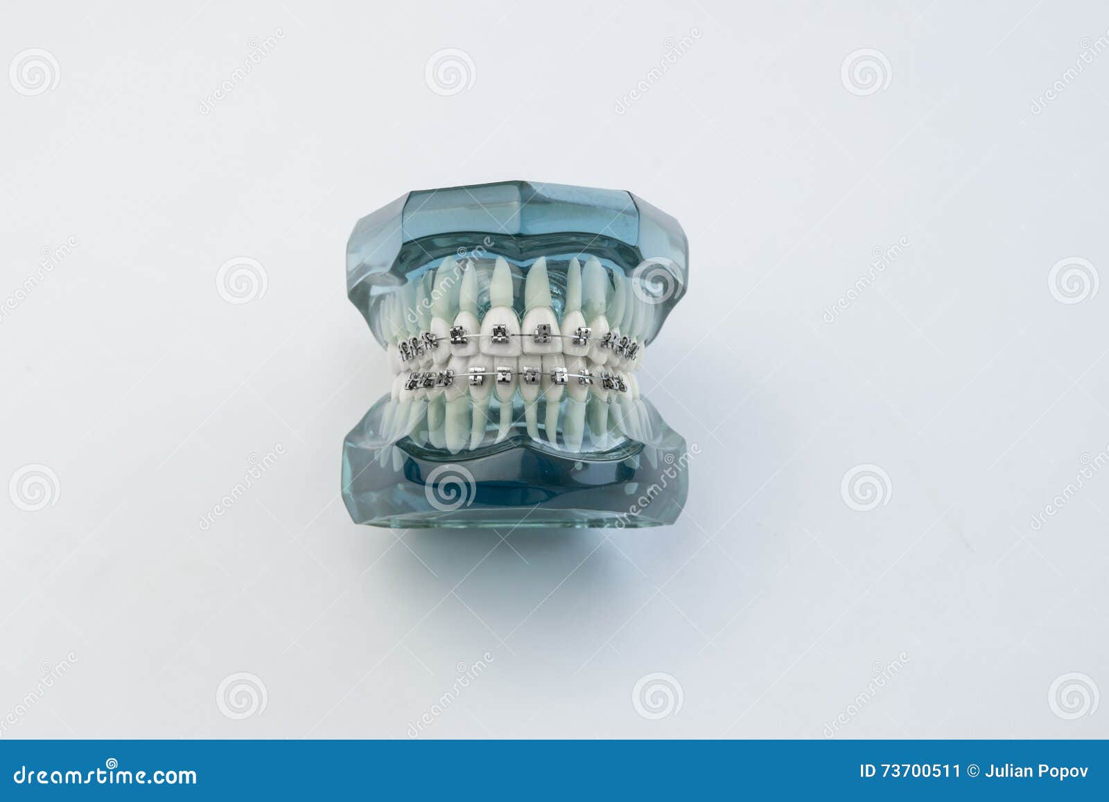 Model of Human Jaw with Wire Braces Attacheg on White Backgroun Stock ...