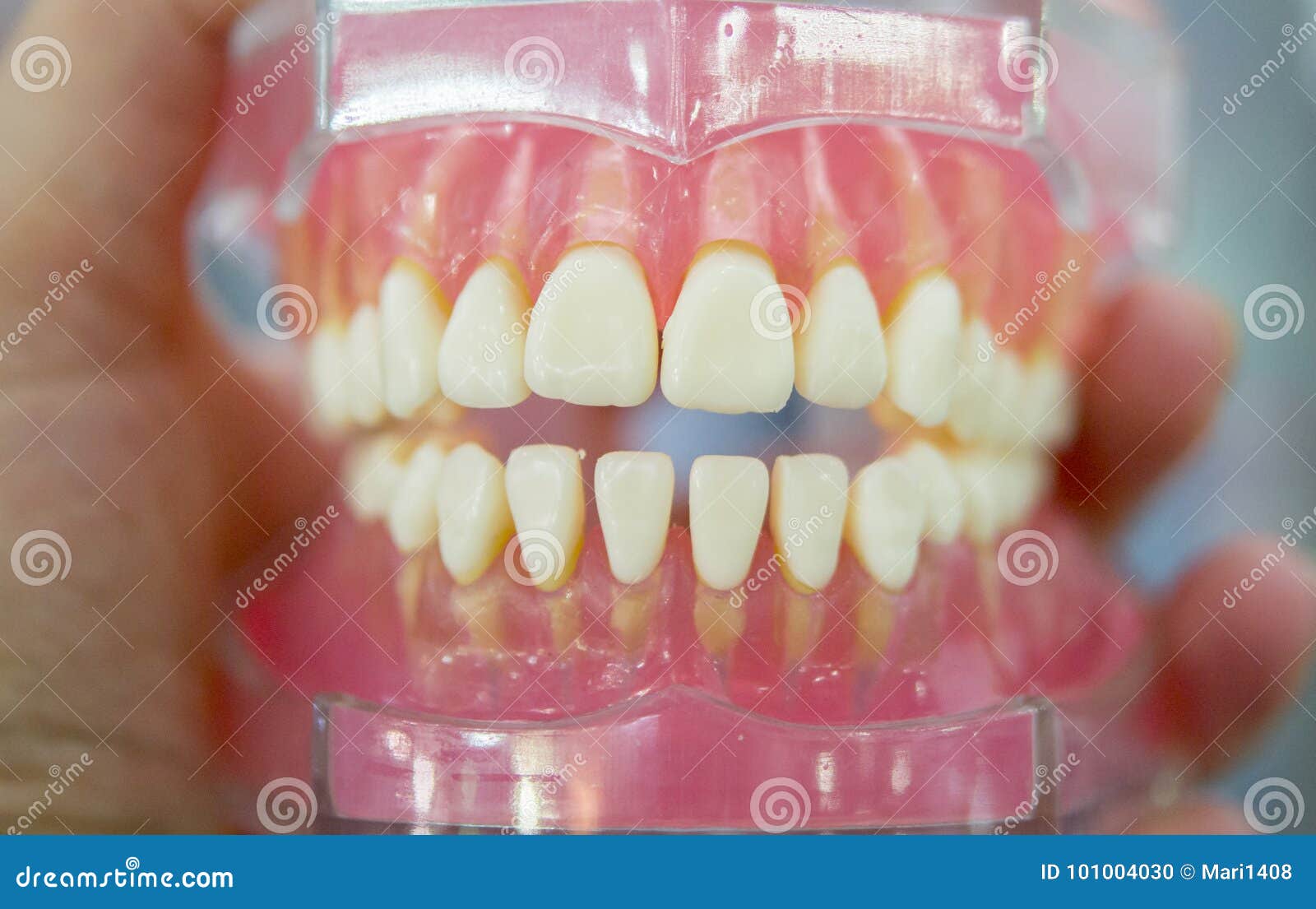 Model of Human Teeth of the Human Jaw Stock Photo - Image of gingiva ...