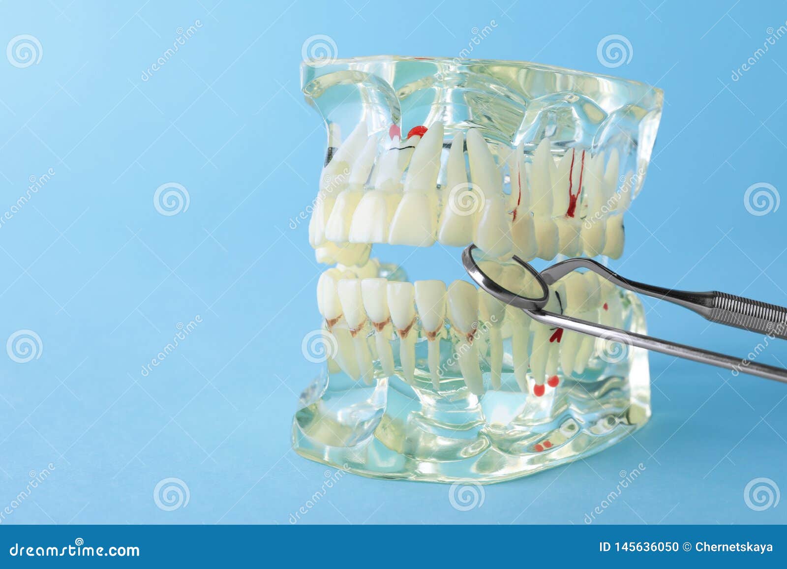 Model of Oral Cavity with Teeth and Dentist Tools Stock Photo - Image ...