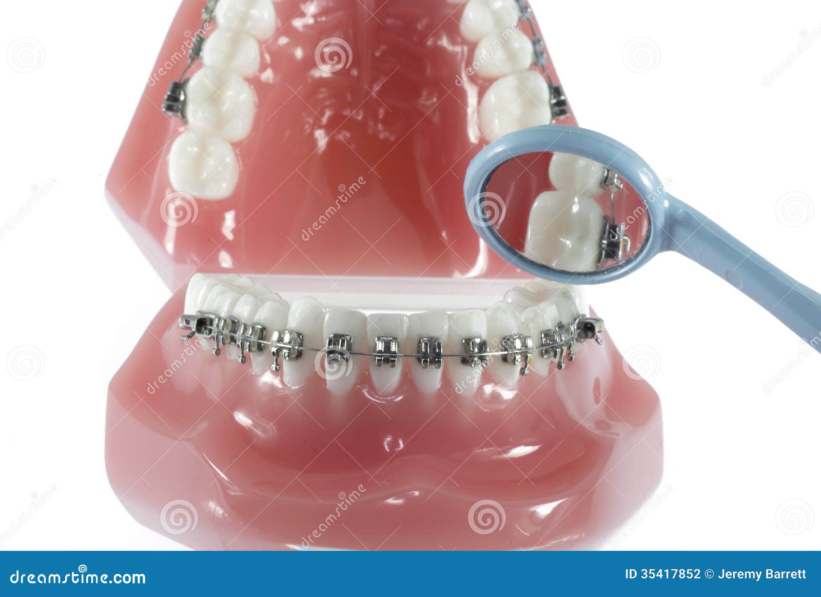 Model of Teeth with Braces and Mirror Stock Photo - Image of hand ...