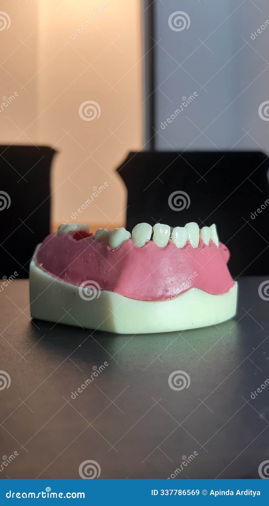 A Model of Tooth that Has a Missing One of the Molars Stock Image ...
