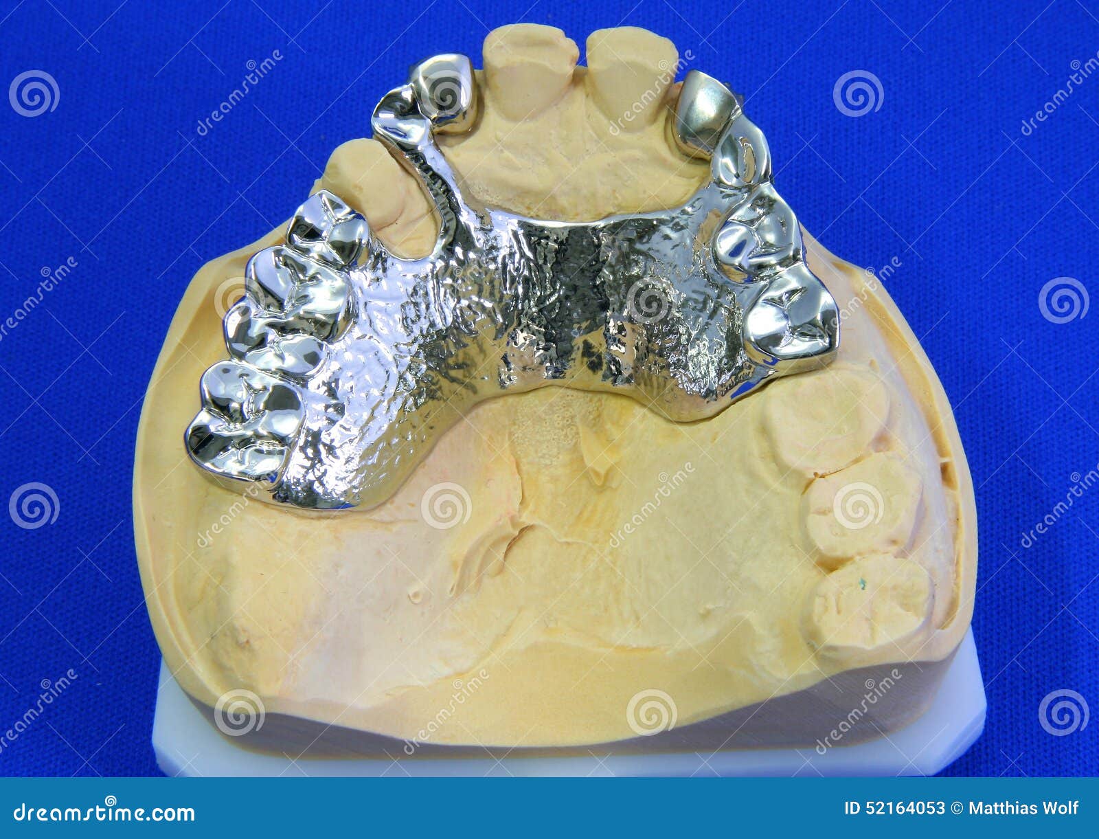 Modelcast stock image. Image of casting, modelcast, dental - 52164053