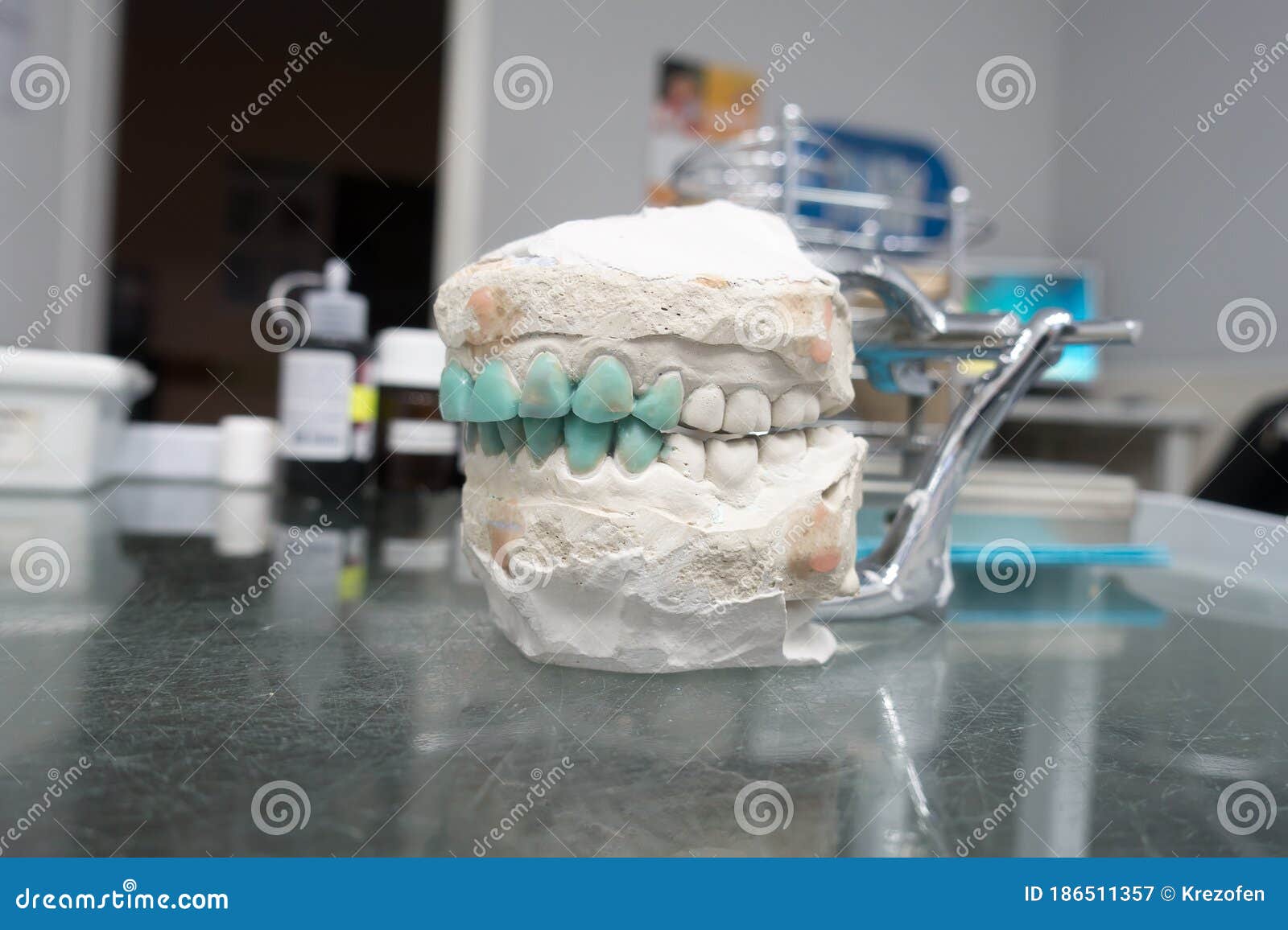Modeling of Artificial Teeth on a Plaster Model Stock Image - Image of ...