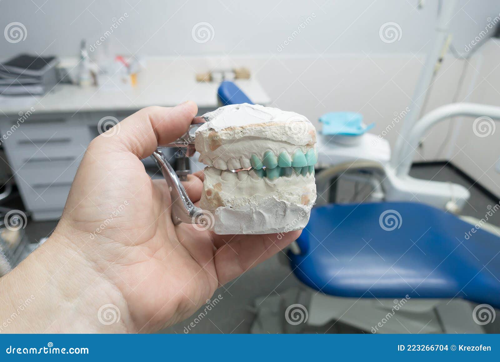 Modeling of Artificial Teeth on a Plaster Model Stock Photo - Image of ...
