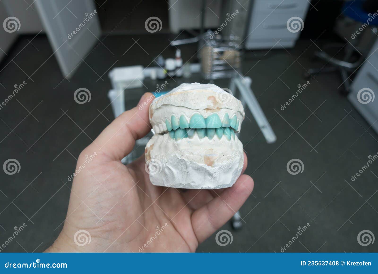 Modeling of Artificial Teeth on a Plaster Model Stock Photo - Image of ...