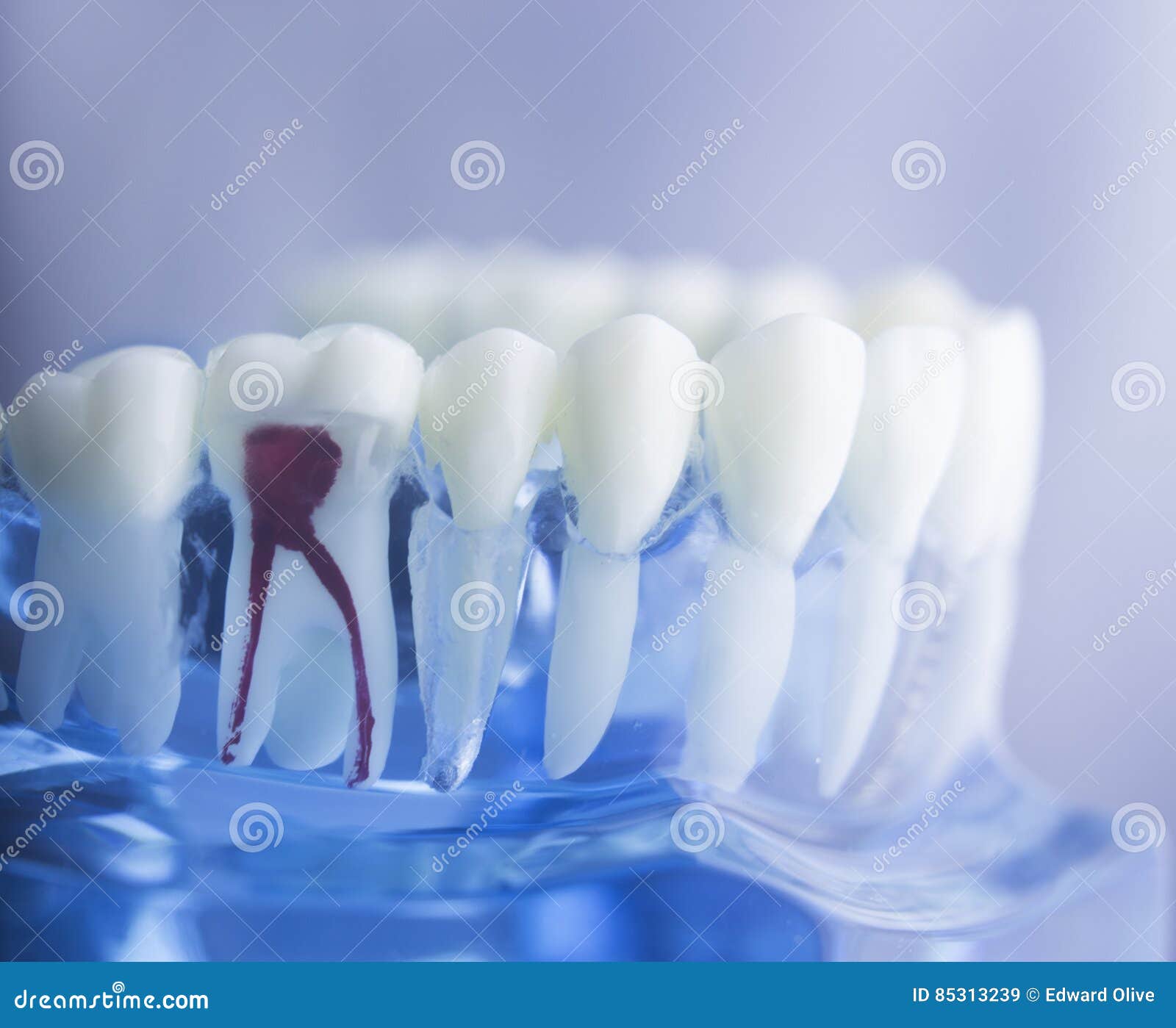 Modello Dentario Della Radice Di Dente Immagine Stock - Immagine di ...