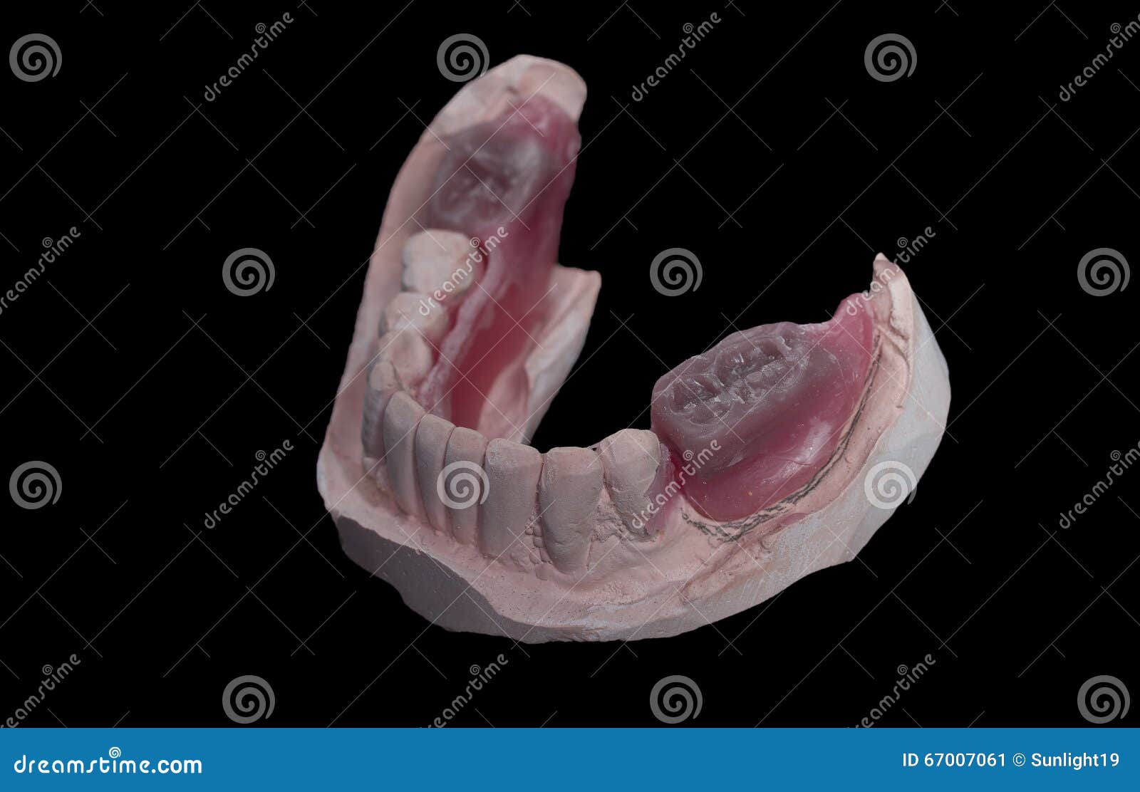 Modelo Dental Con Los Dientes Hechos En Cera Imagen de archivo - Imagen ...