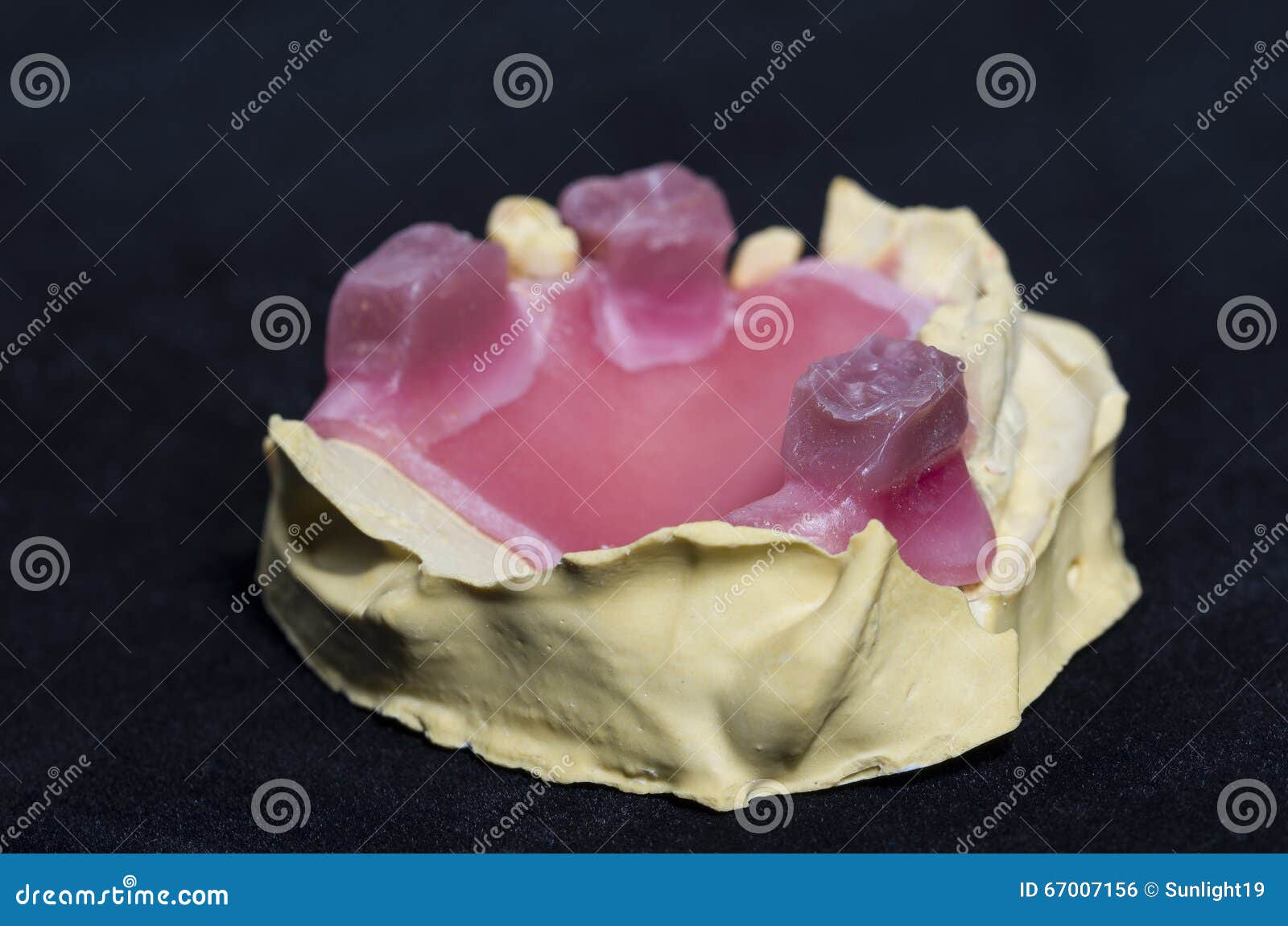 Modelo Dental Con Los Dientes Hechos En Cera Foto de archivo - Imagen ...