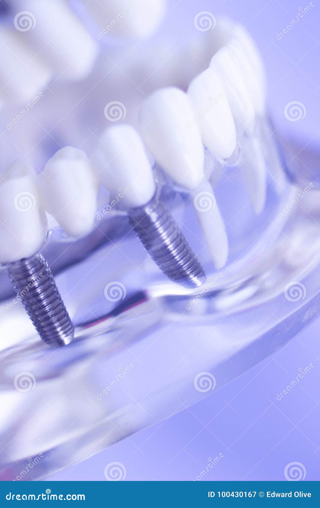 Modelo Dental De La Boca De Los Dientes Imagen de archivo - Imagen de ...