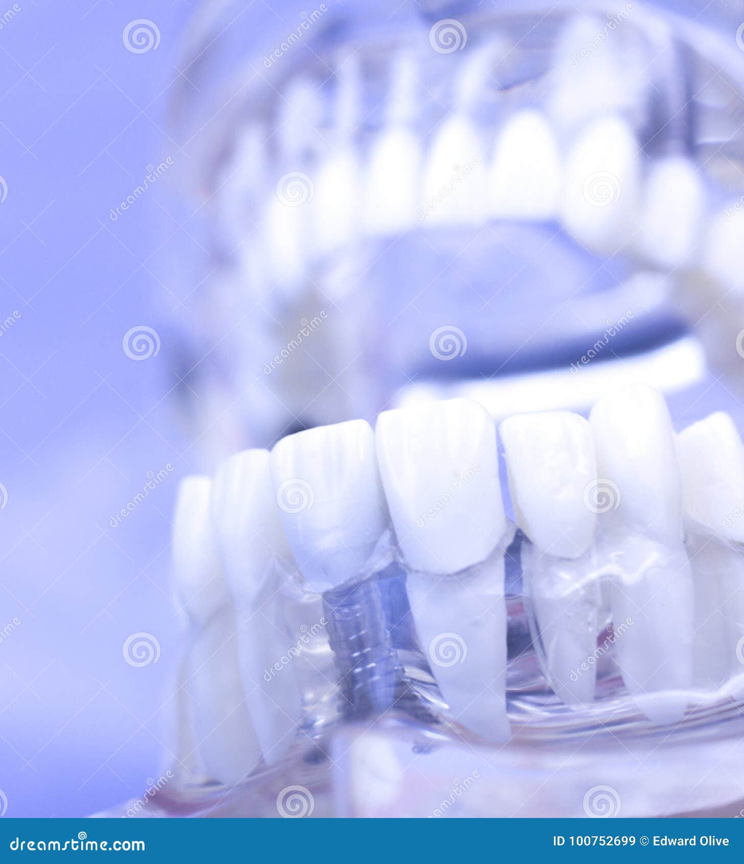 Modelo Dental De La Boca De Los Dientes Imagen de archivo - Imagen de ...