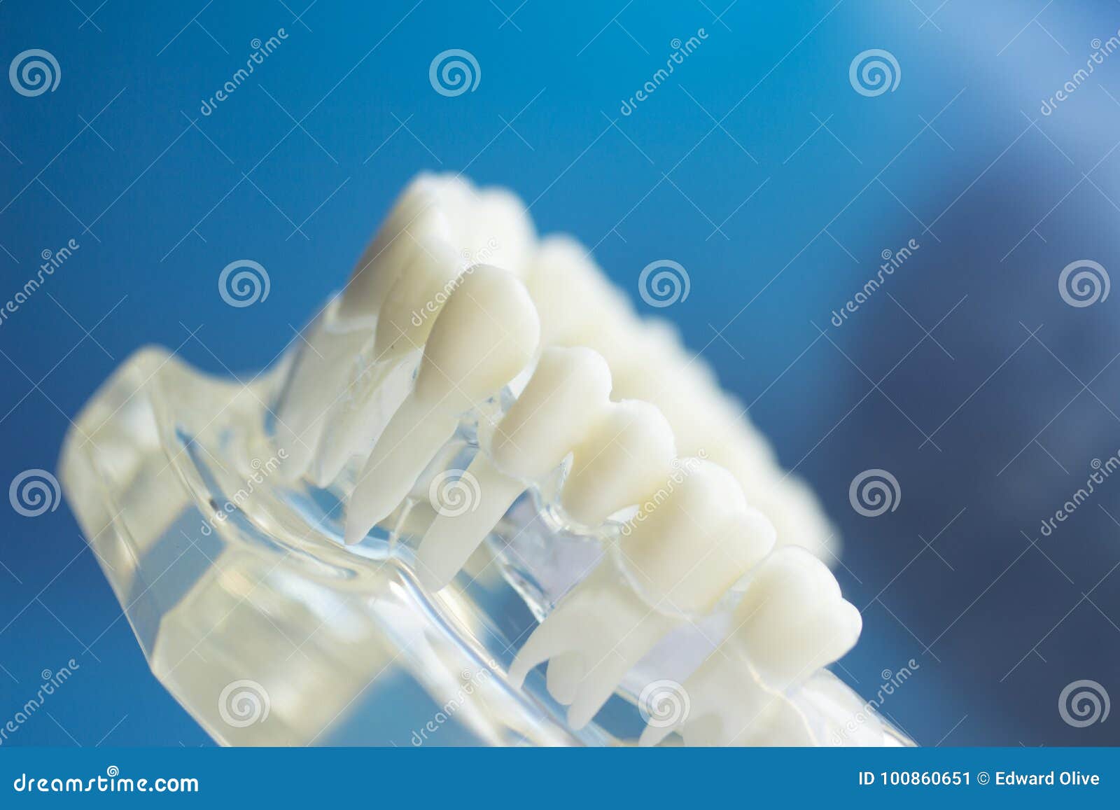 Modelo Dental De La Boca De Los Dientes Imagen de archivo - Imagen de ...