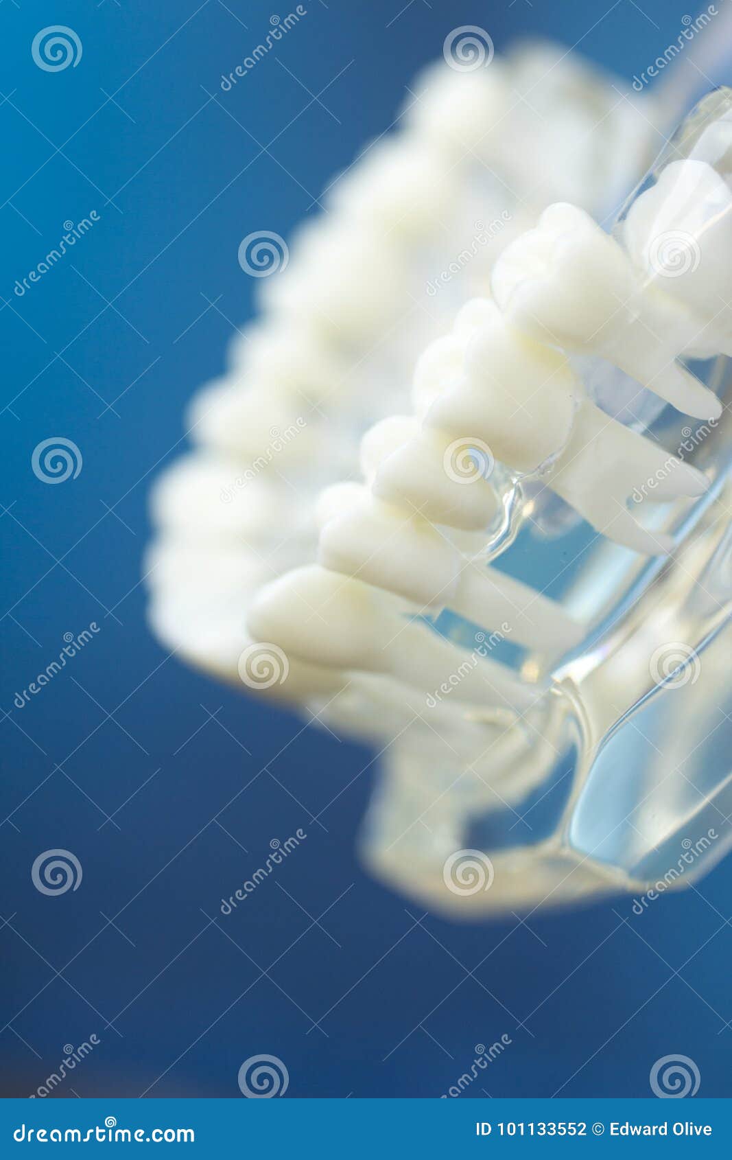 Modelo Dental De La Boca De Los Dientes Foto de archivo - Imagen de ...