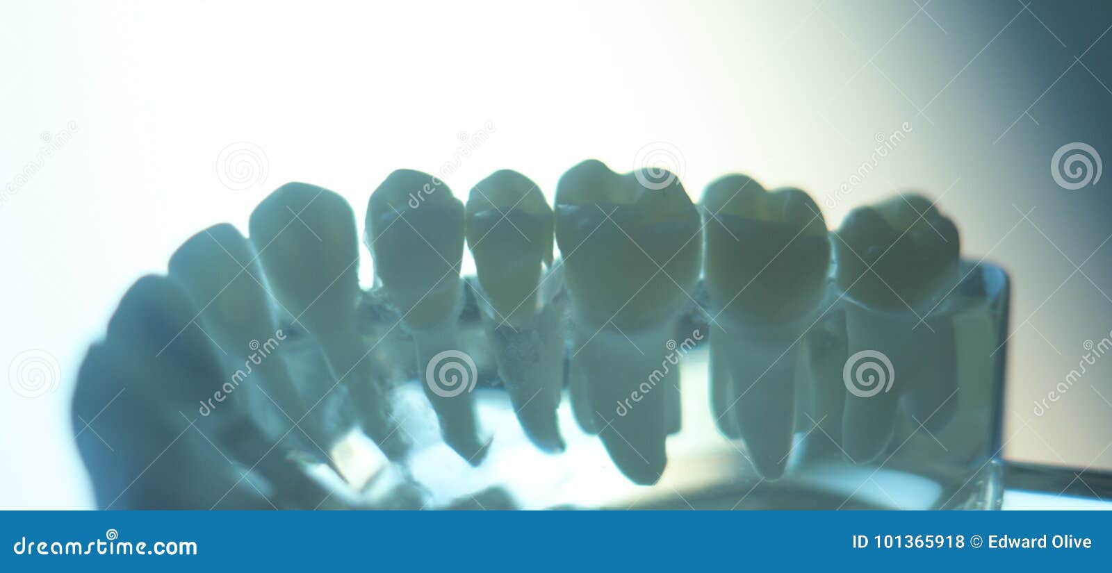 Modelo Dental De La Boca De Los Dientes Foto de archivo - Imagen de ...